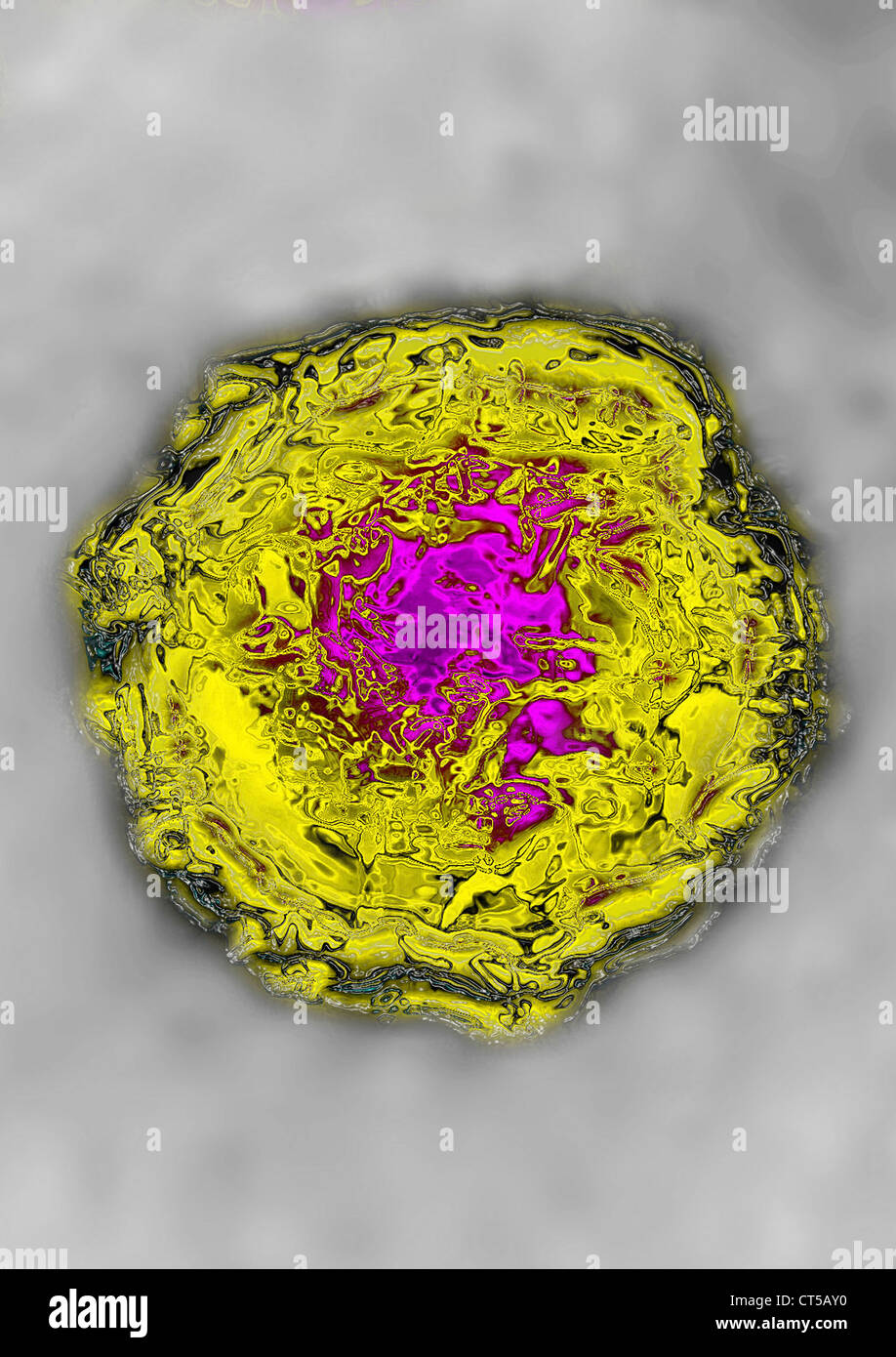 Polio Virus Micrograph High Resolution Stock Photography and Images - Alamy