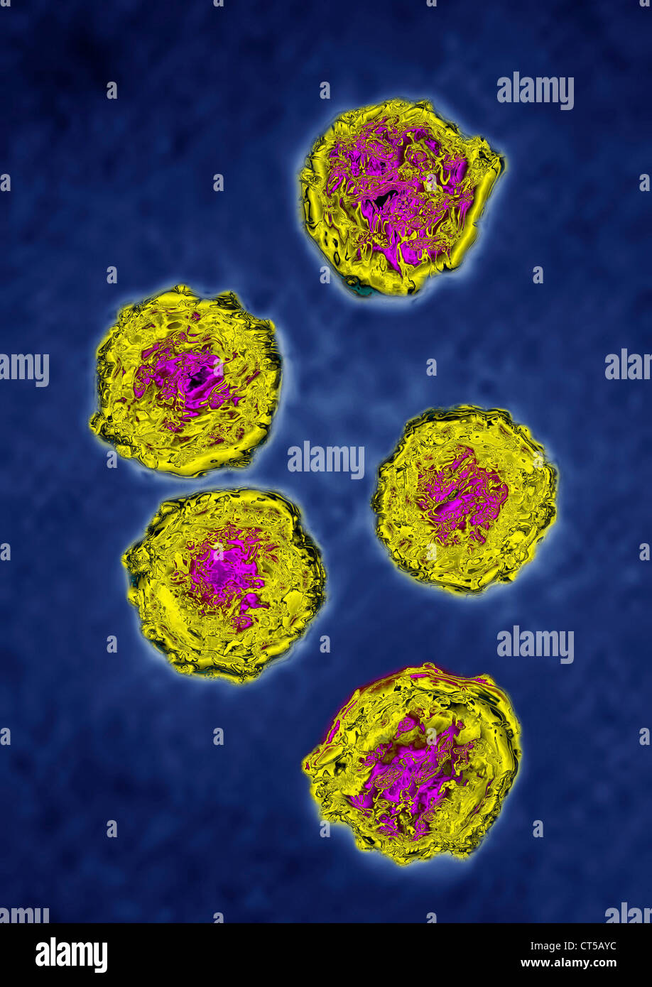 Polio virus micrograph hi-res stock photography and images - Alamy