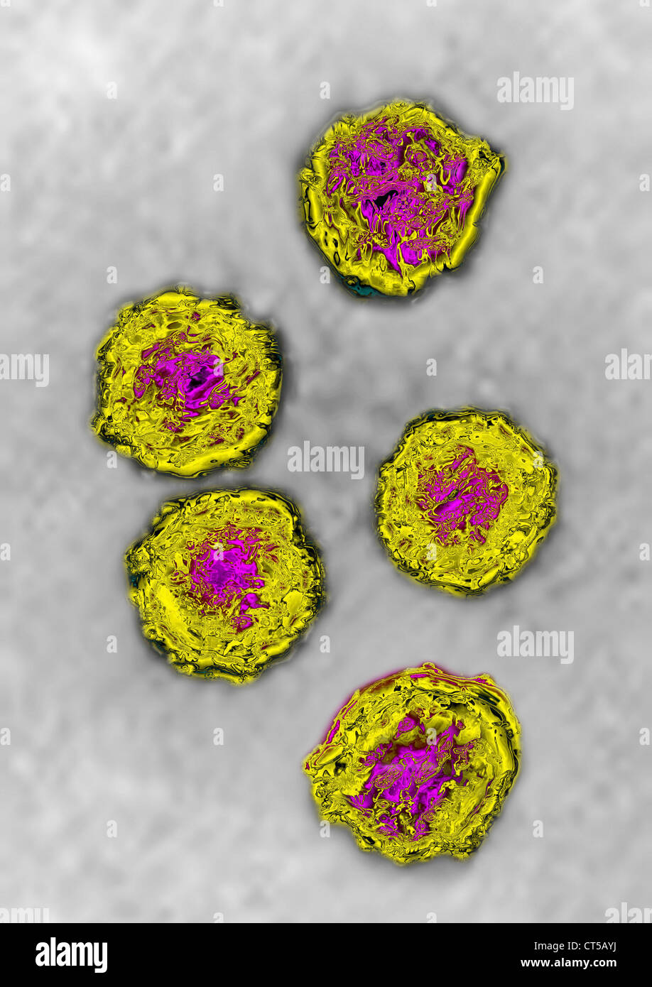 Polio virus micrograph hi-res stock photography and images - Alamy