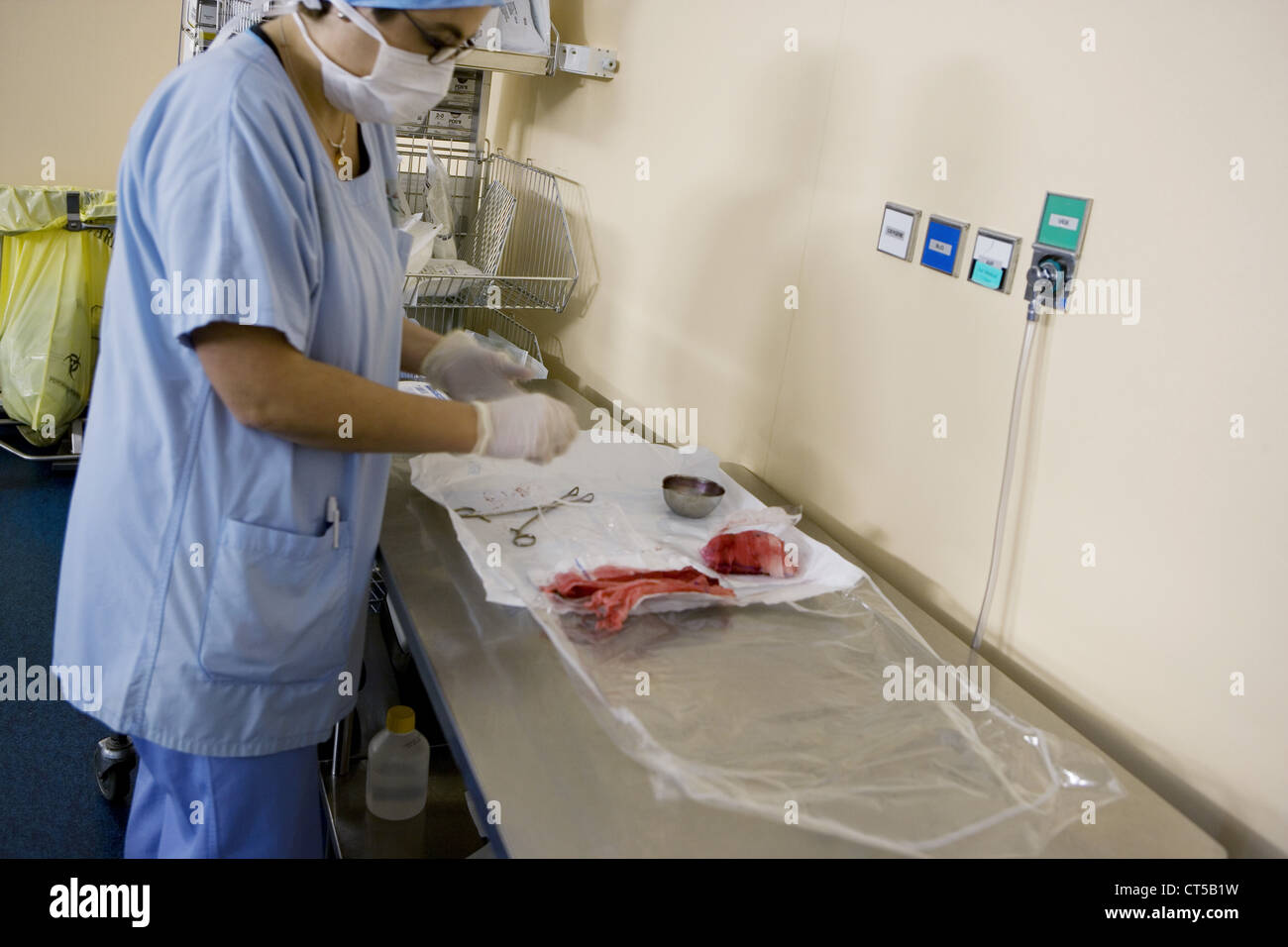 Gastrectomies hi-res stock photography and images - Alamy