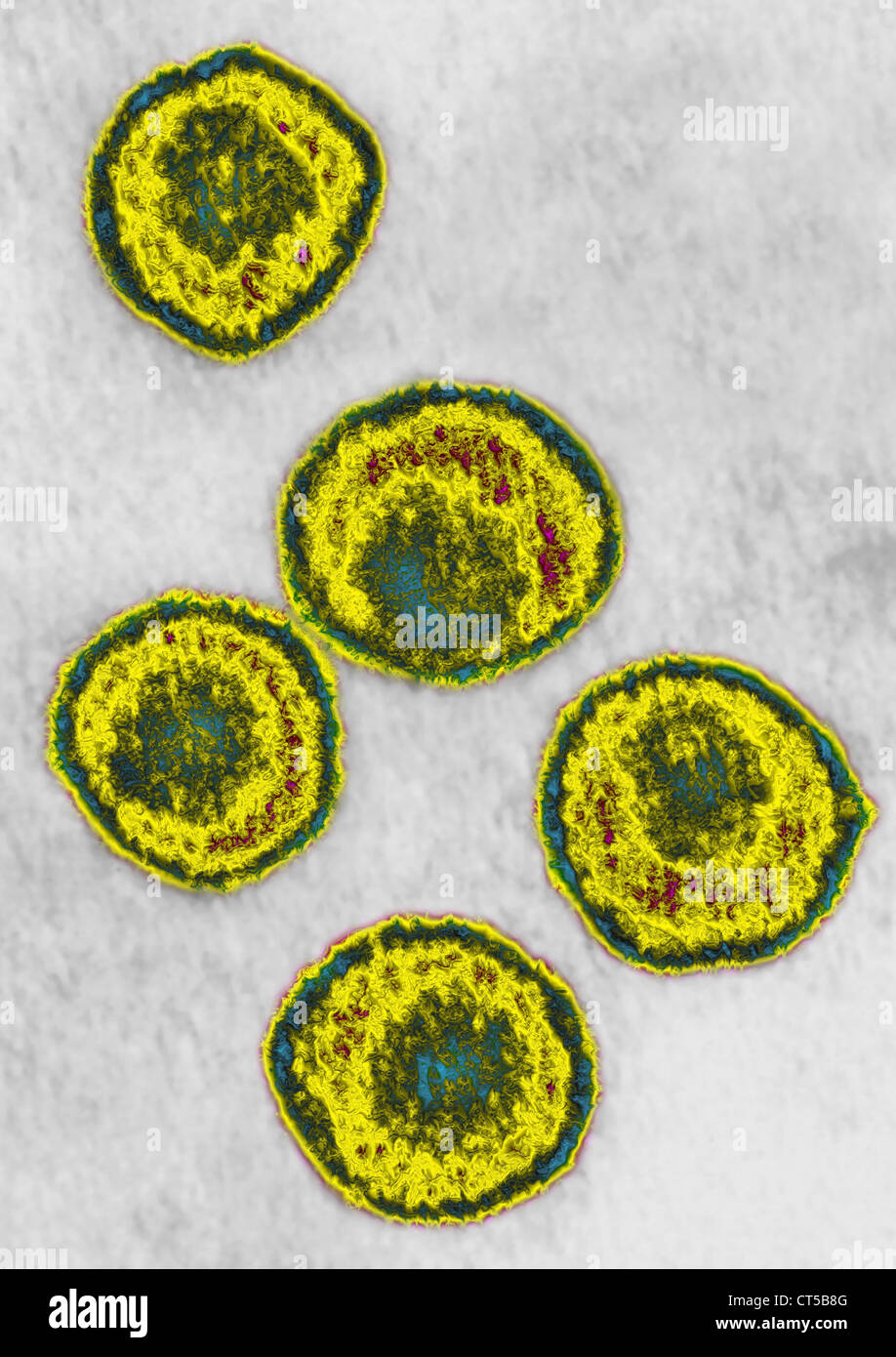 HERPES SIMPLEX VIRUS Stock Photo - Alamy