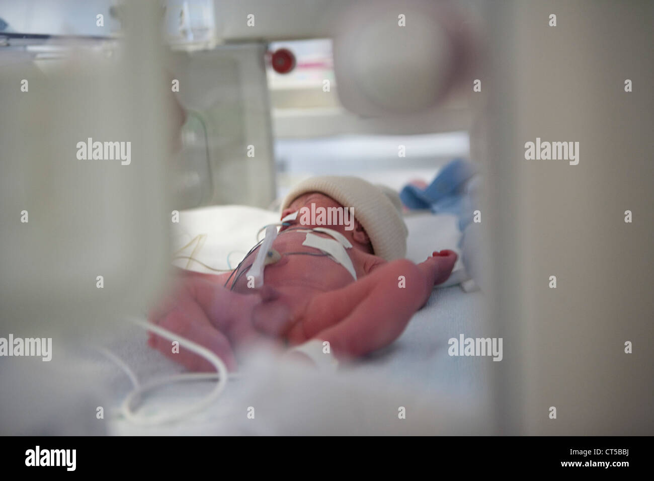 Baby clamp umbilical cord hi-res stock photography and images - Alamy