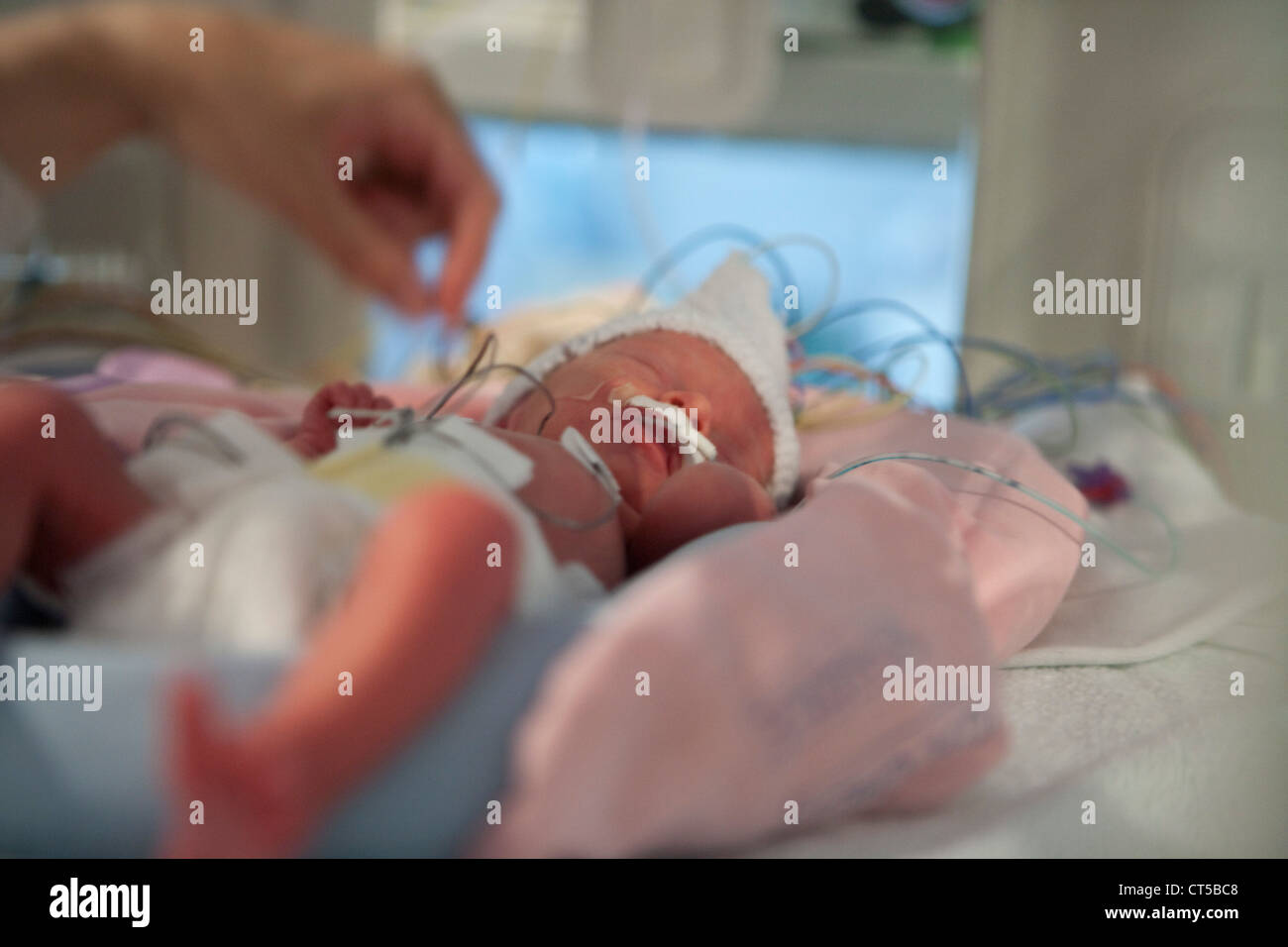 EEG EXAMINATION PREMATURE BABY Stock Photo - Alamy