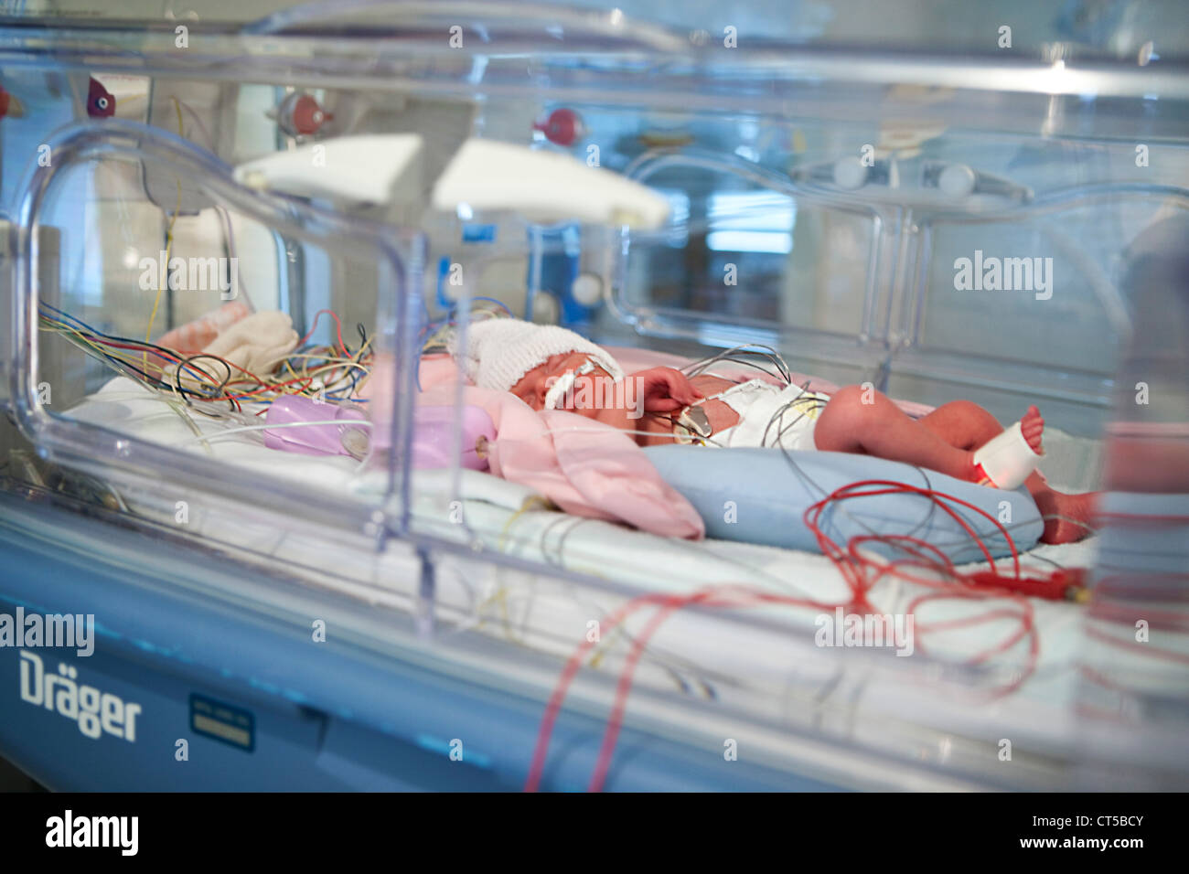 EEG EXAMINATION PREMATURE BABY Stock Photo - Alamy