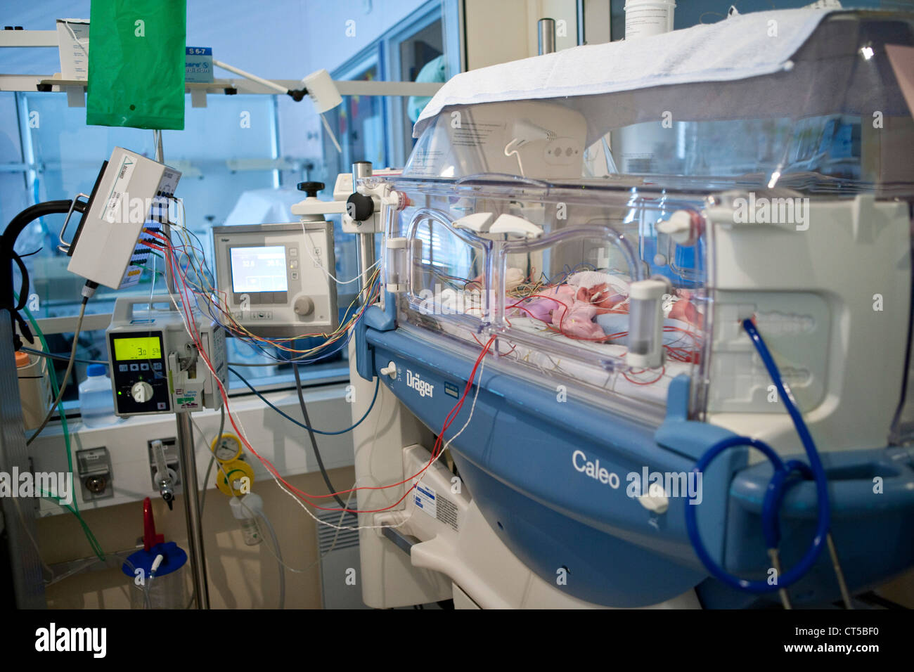 EEG EXAMINATION PREMATURE BABY Stock Photo - Alamy