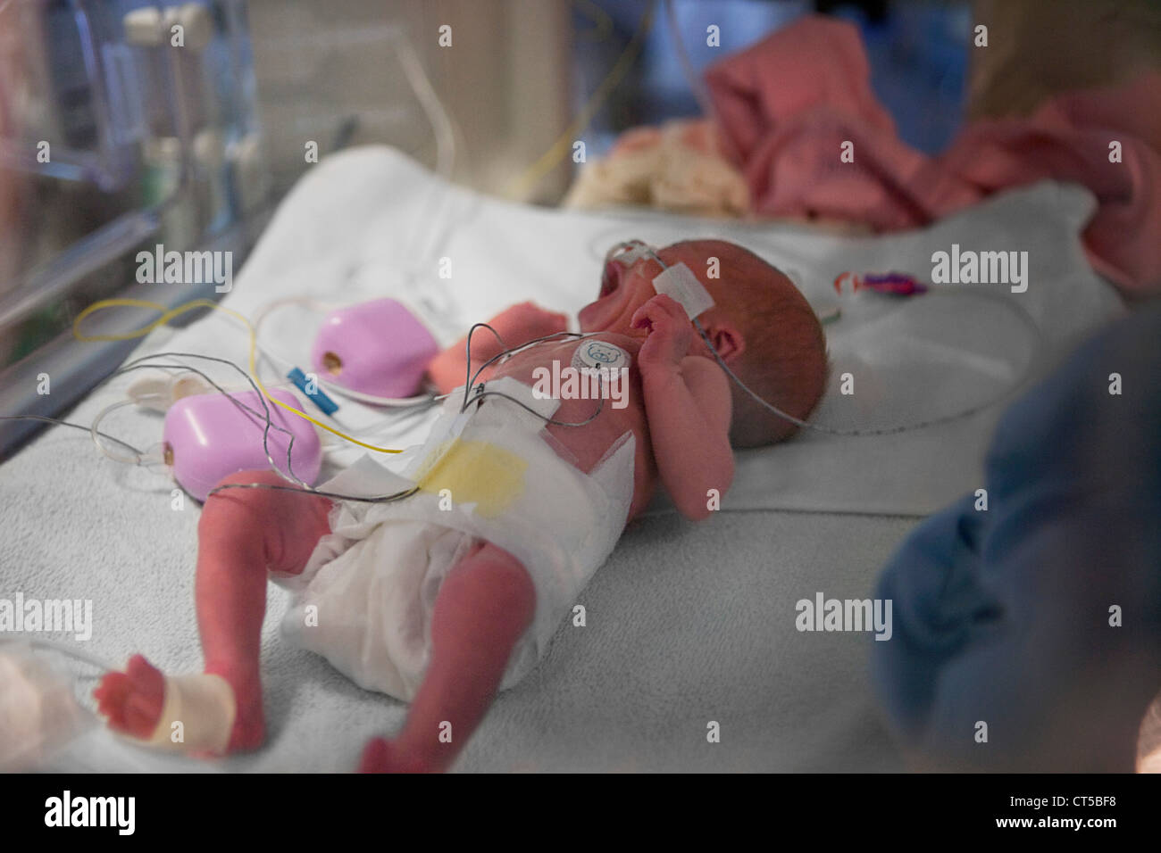 Pre term baby hi-res stock photography and images - Alamy