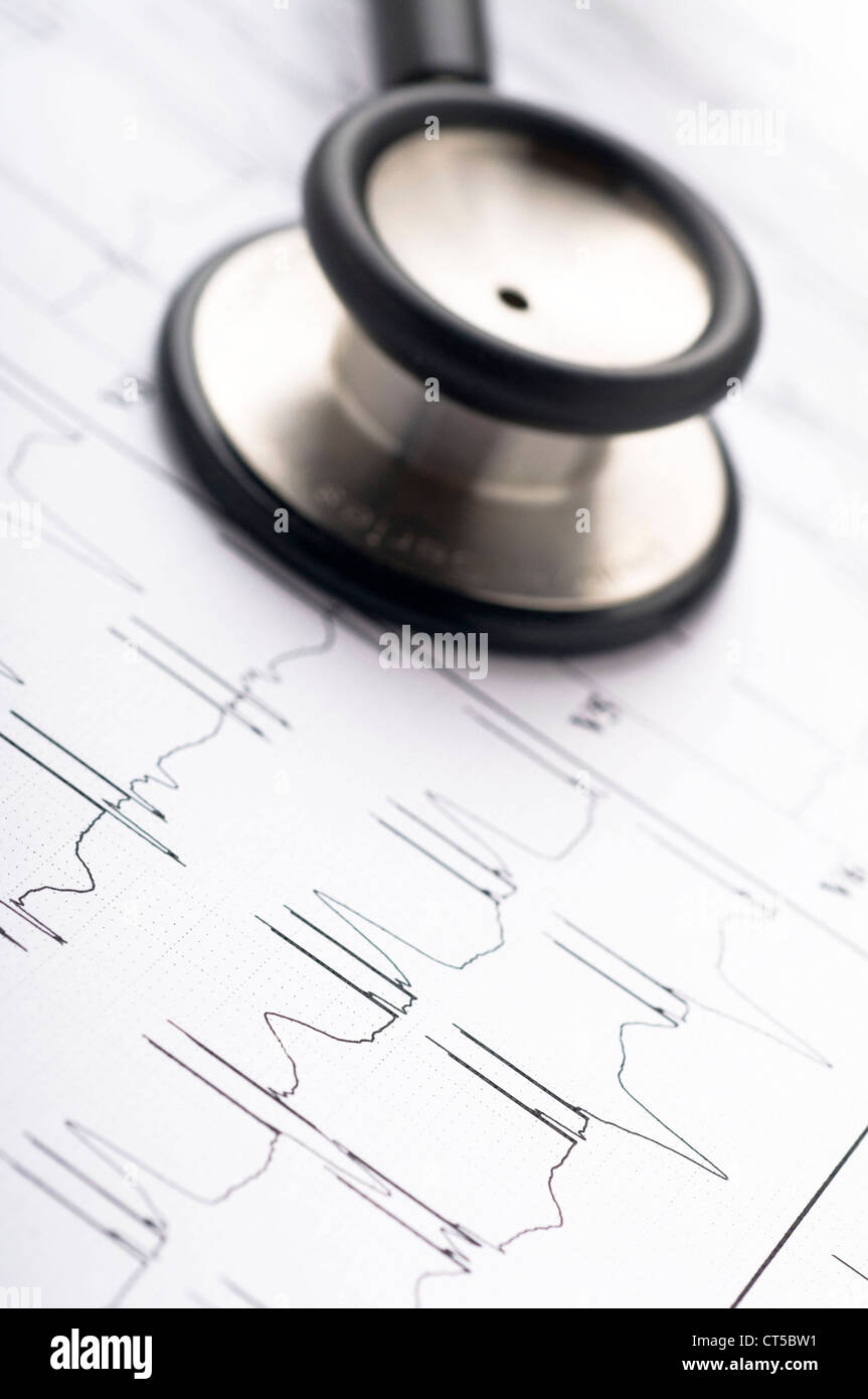 Ecg trace hi-res stock photography and images - Alamy
