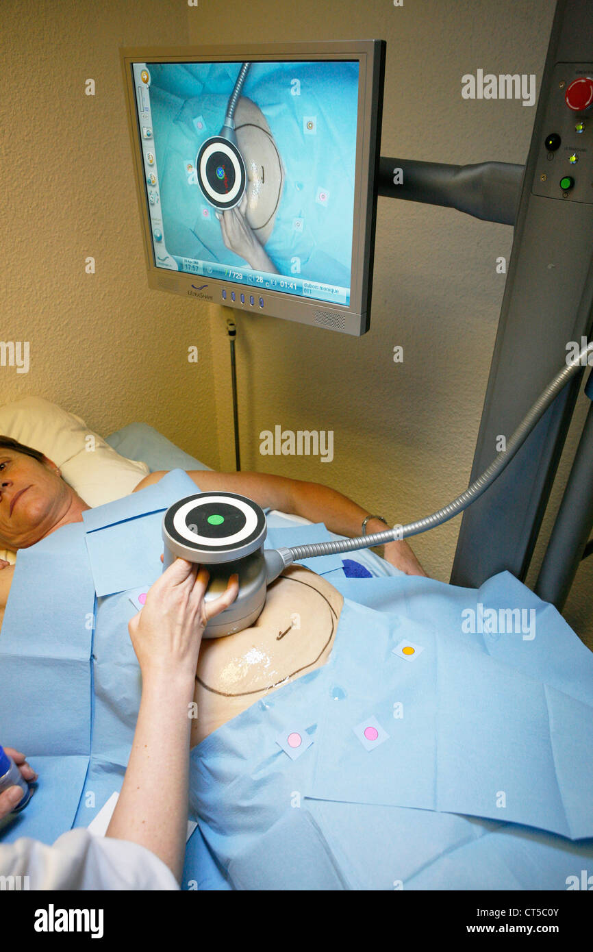 Cellulitis Treatment High Resolution Stock Photography and Images - Alamy