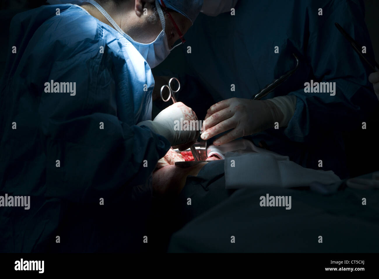 Nephrectomy hi-res stock photography and images - Alamy