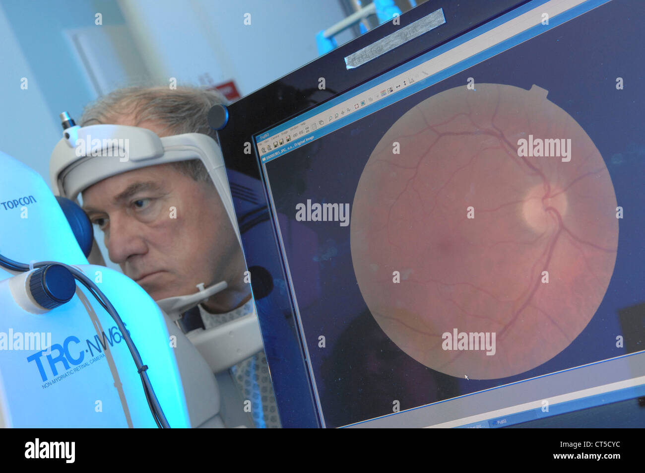 FUNDUS OCULI EXAMINATION Stock Photo - Alamy