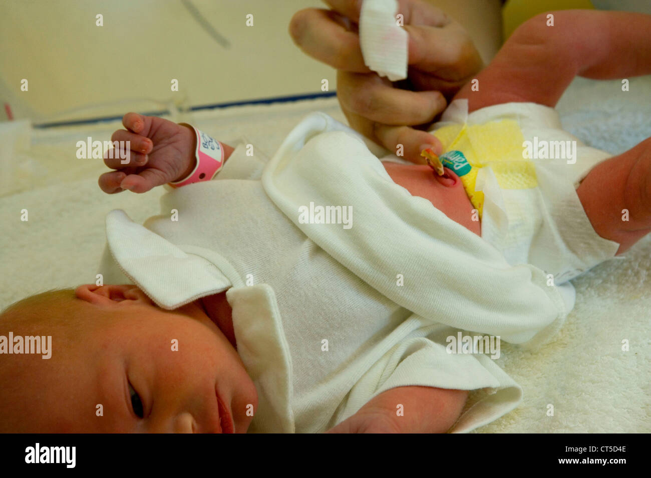 Newborn baby girl umbilical cord hi-res stock photography and images ...
