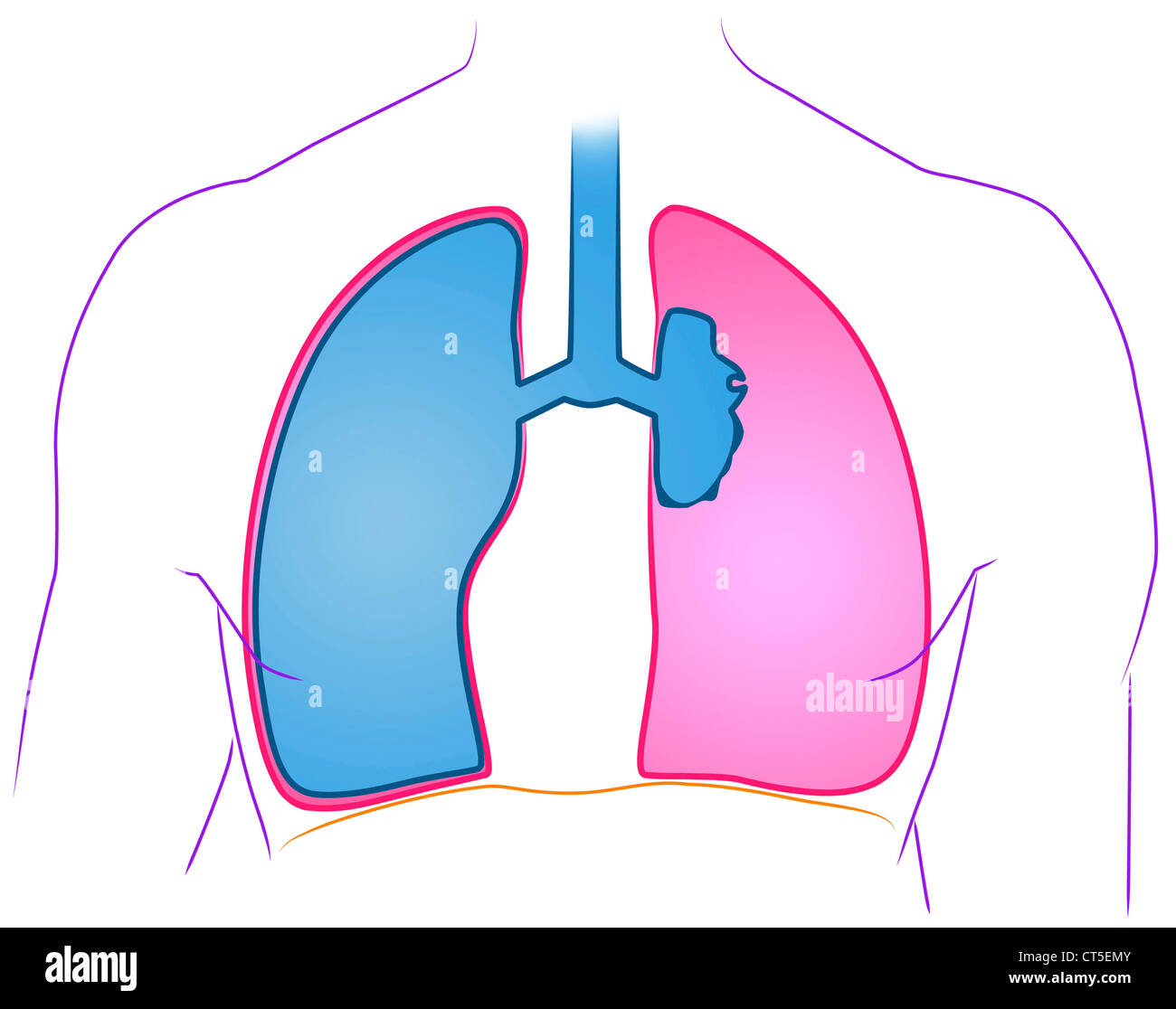 Pneumothorax hi-res stock photography and images - Alamy