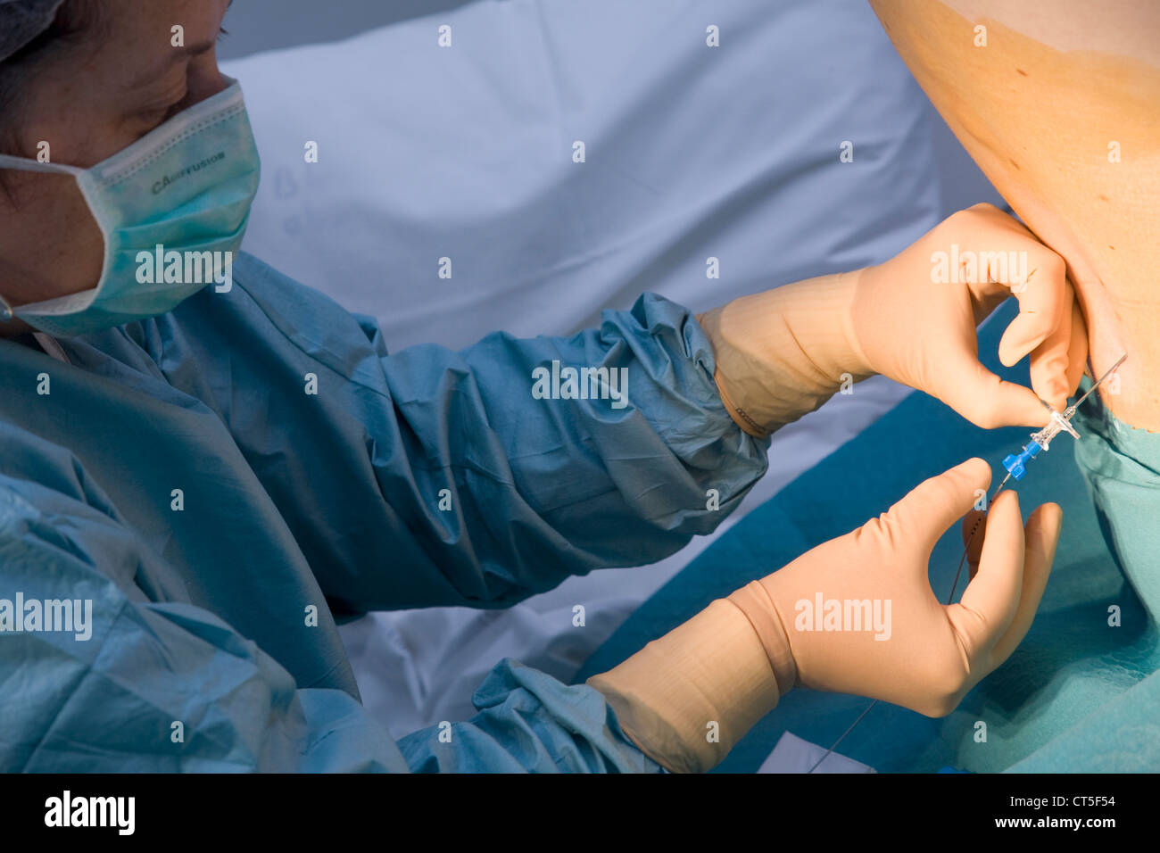 Epidural catheter hi-res stock photography and images - Alamy