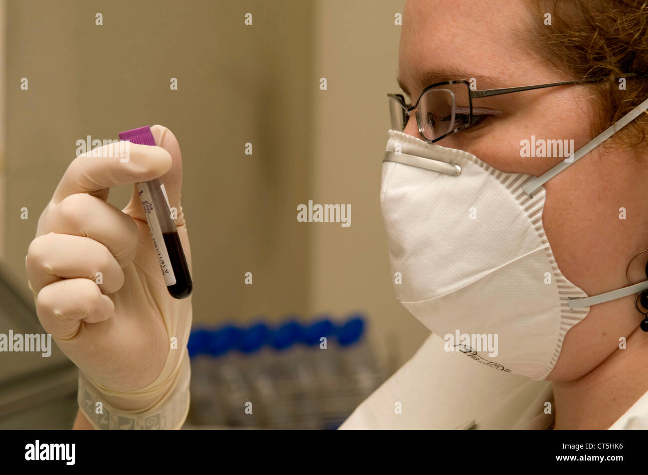 Blood contamination hi-res stock photography and images - Alamy