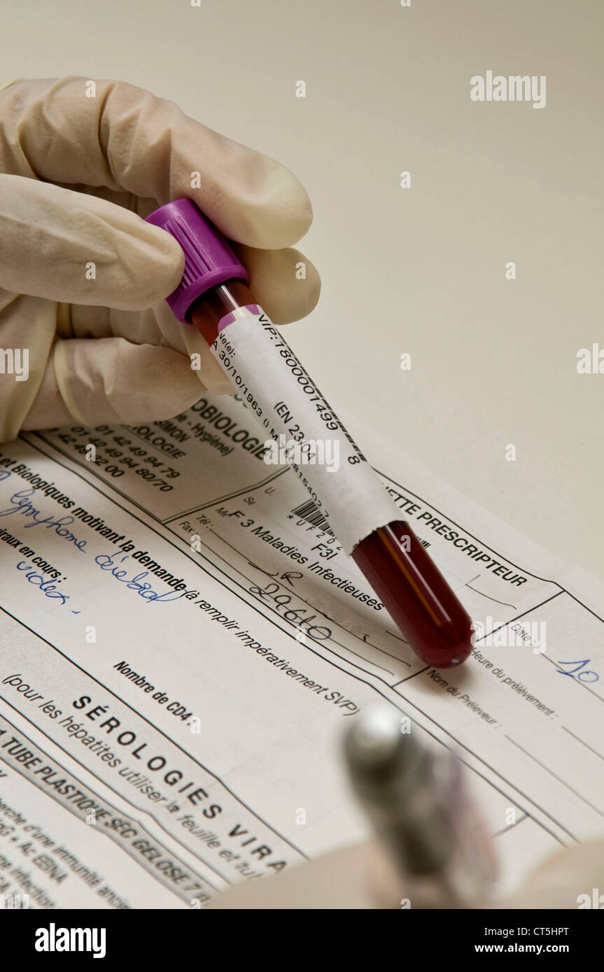BLOOD ANALYSIS Stock Photo - Alamy