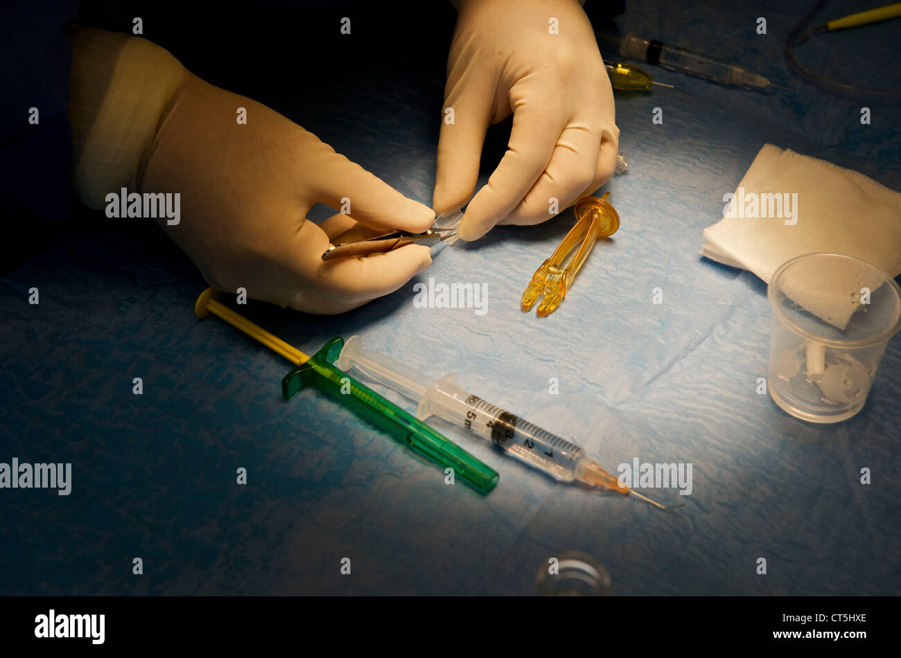 Prosthetic intraocular lens hi-res stock photography and images - Alamy