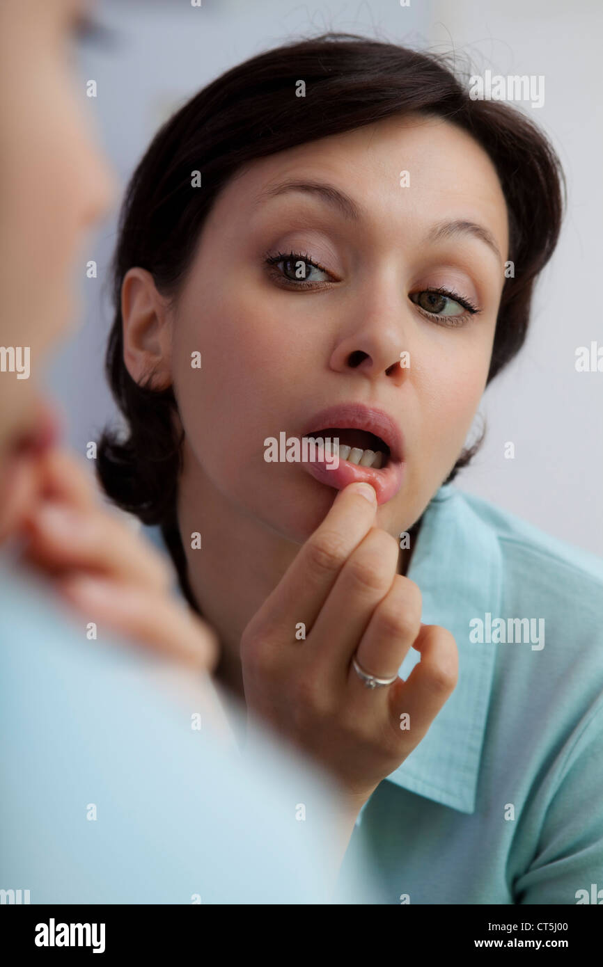 Aphtha hi-res stock photography and images - Alamy