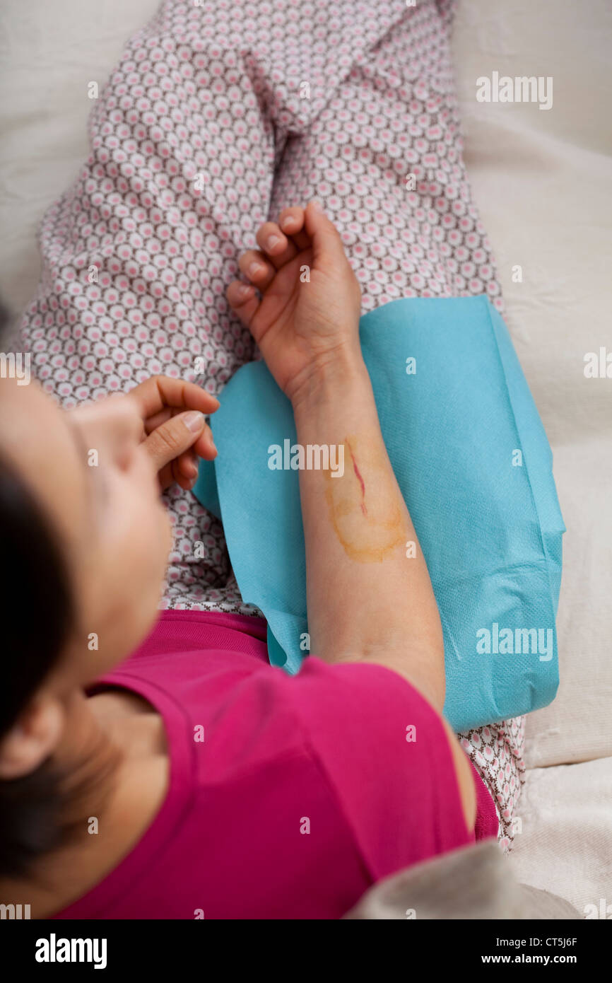 An open sore hi-res stock photography and images - Alamy