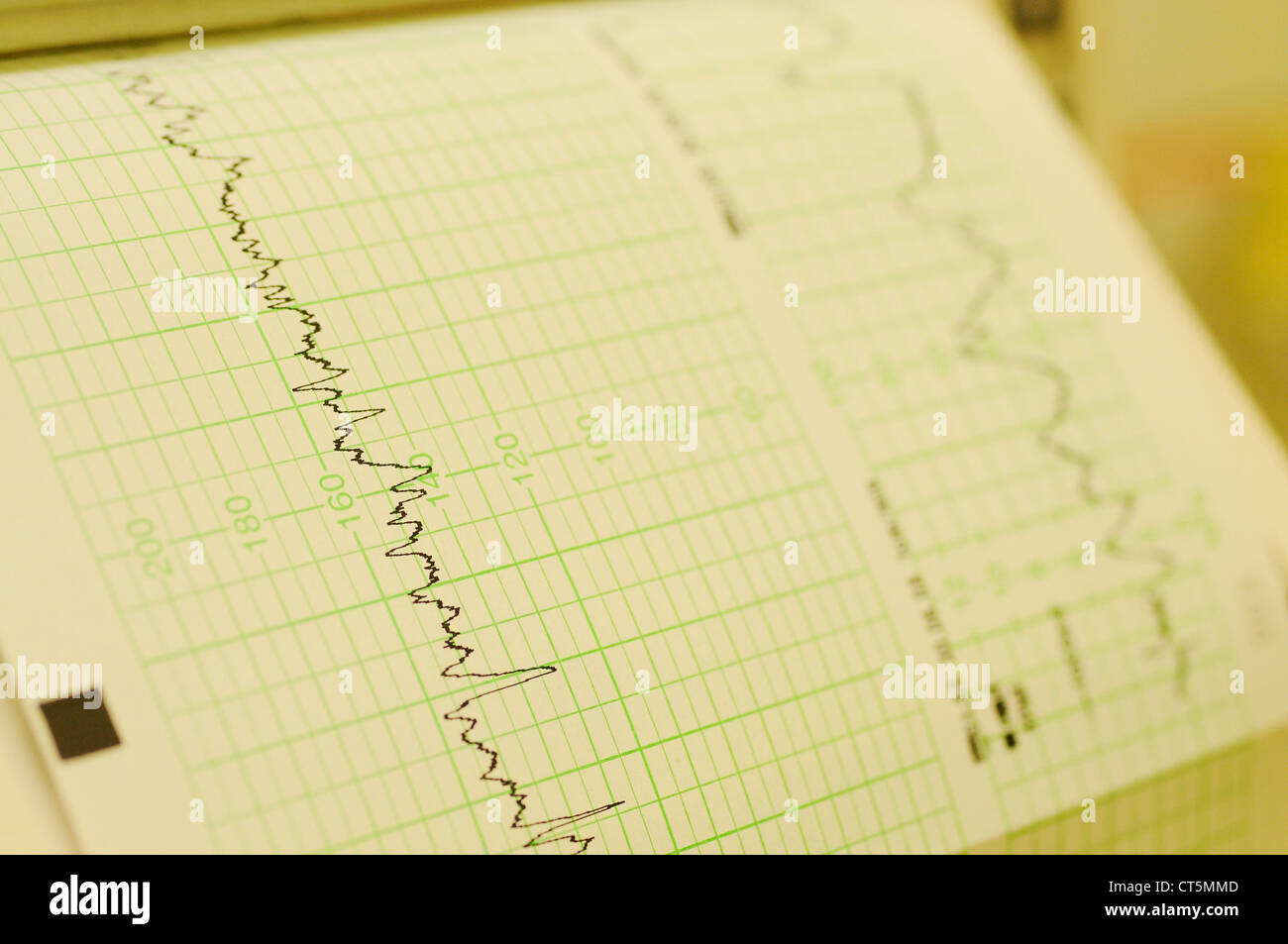 Monitoring contractions hi-res stock photography and images - Alamy