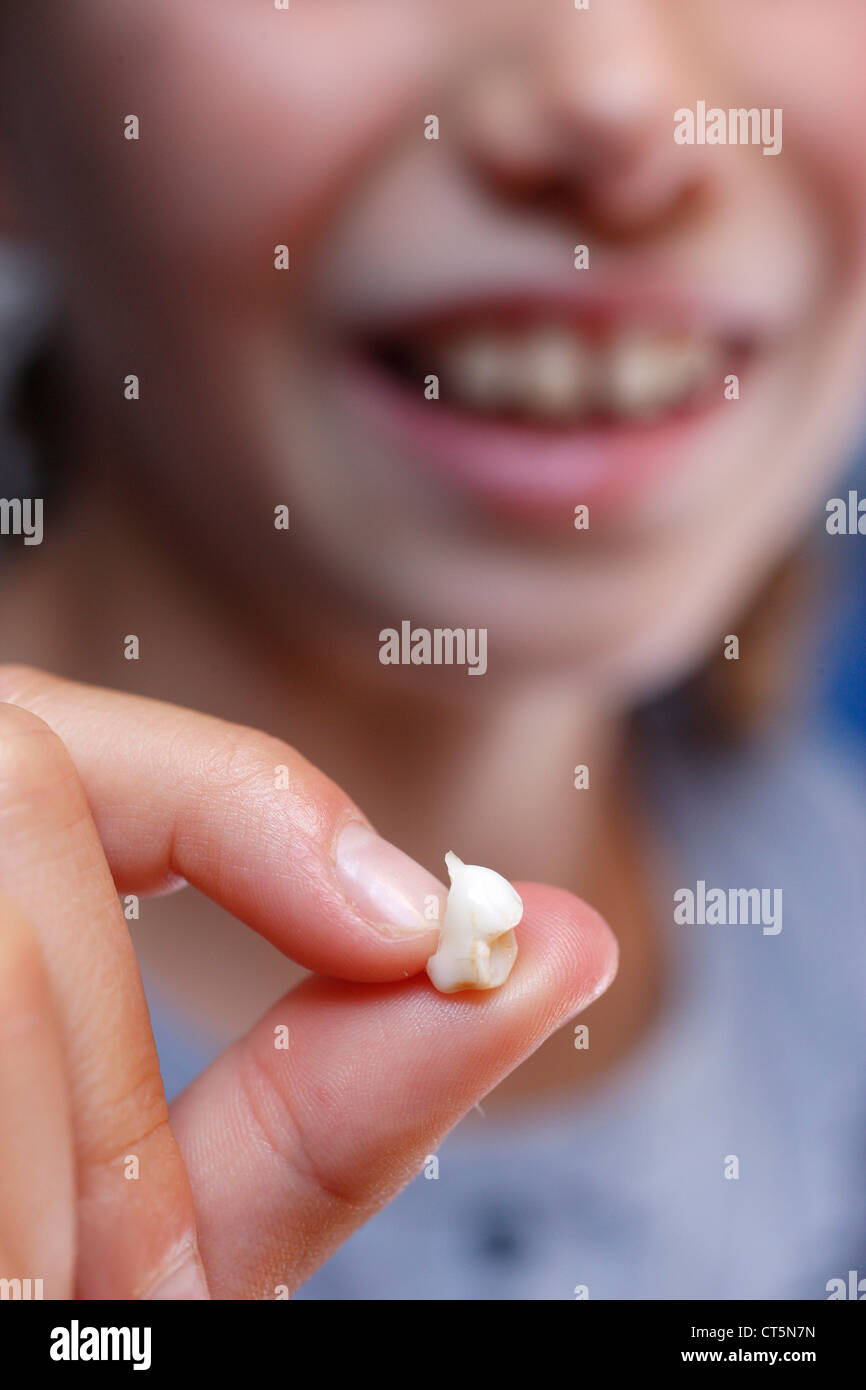 LOSING MILK TEETH Stock Photo - Alamy