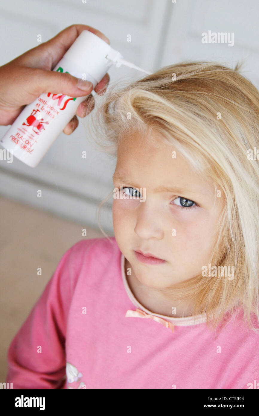 TREATMENT FOR LICE Stock Photo - Alamy