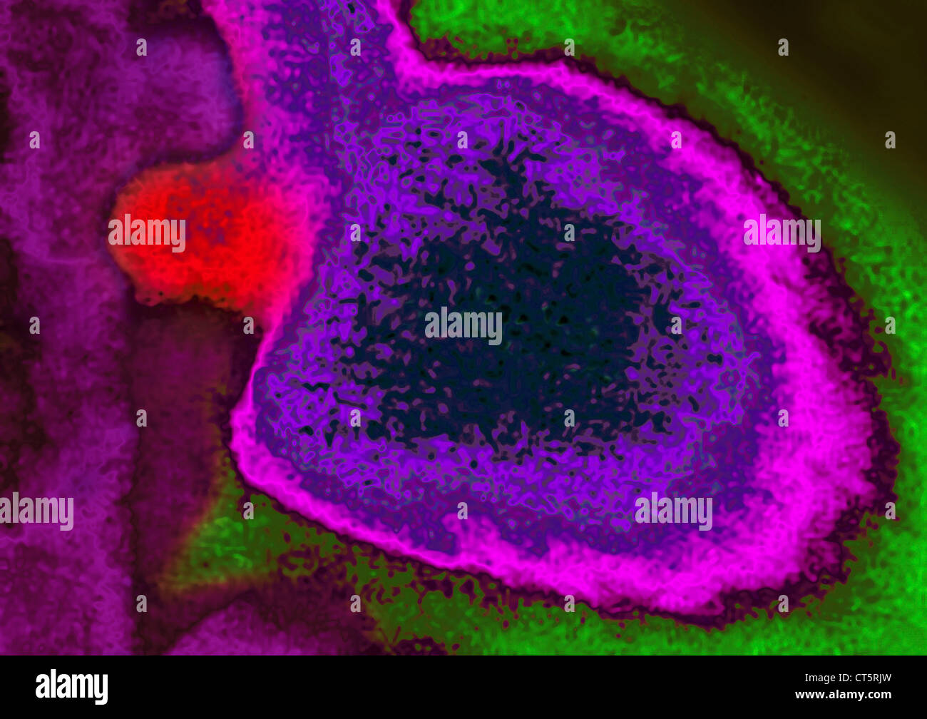 Mitral hi-res stock photography and images - Alamy