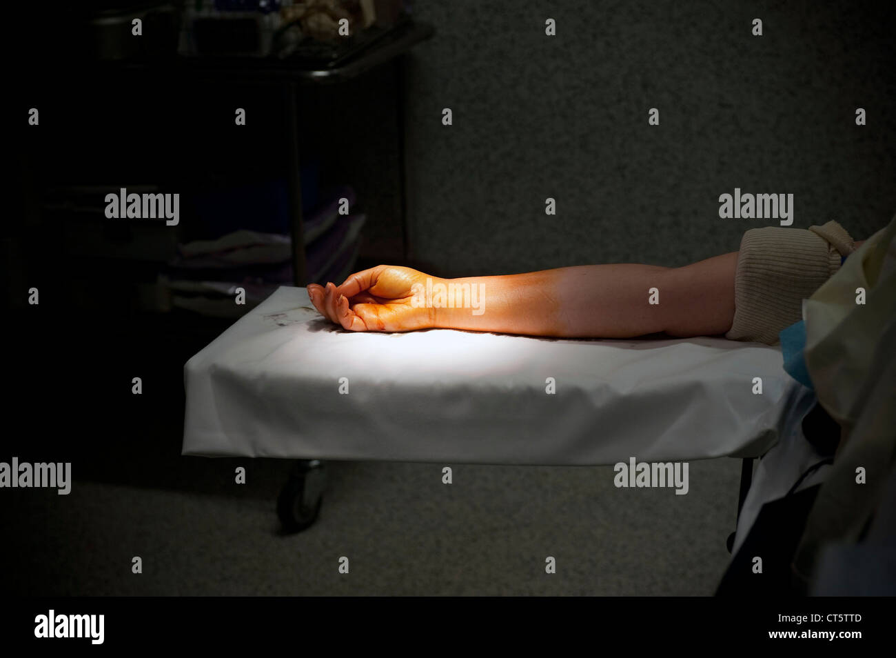 Hand arm surgery orthopedics hi-res stock photography and images - Alamy