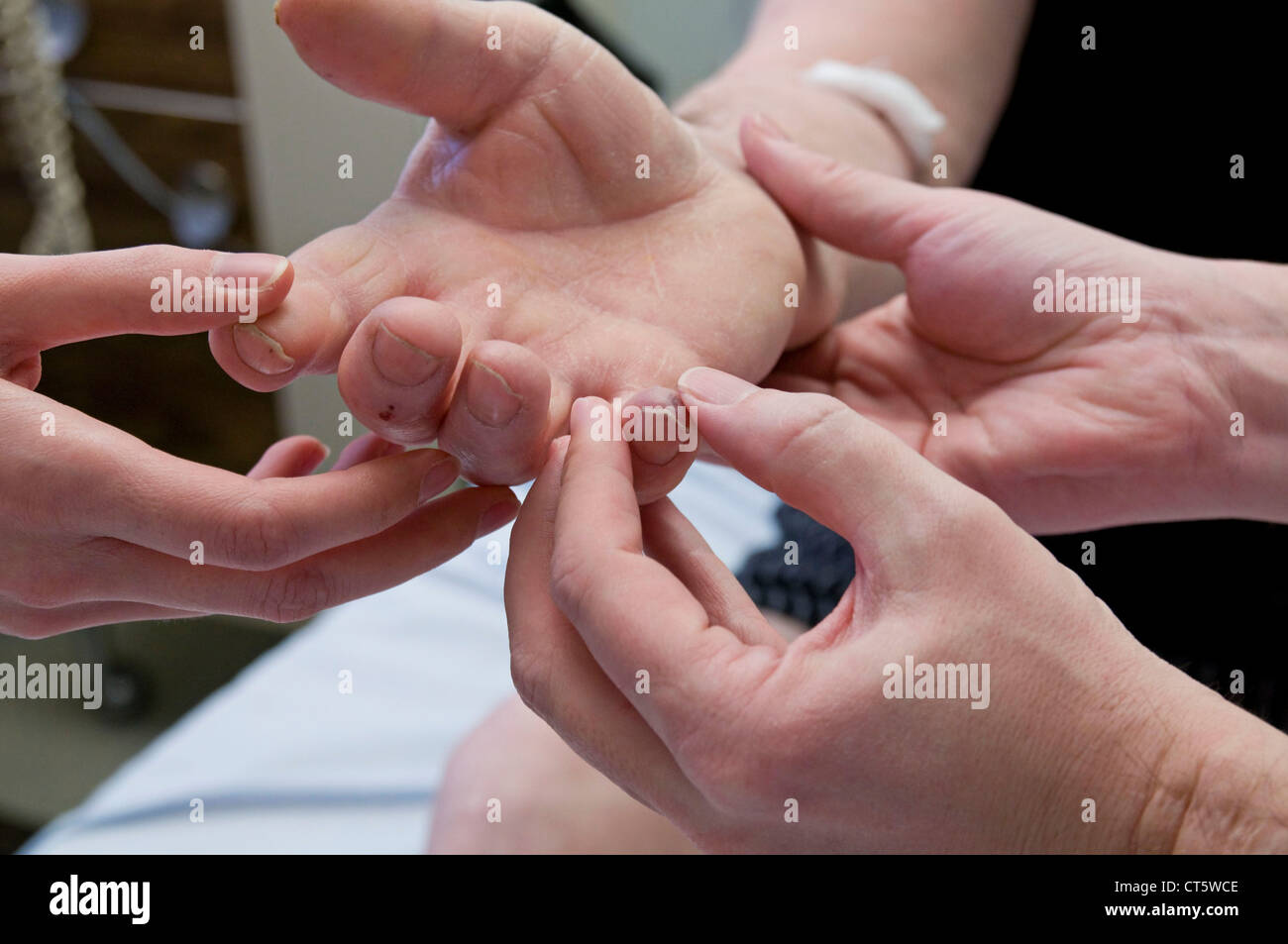DERMATOLOGY, SYMPTOMATOLOGY ELDE Stock Photo - Alamy