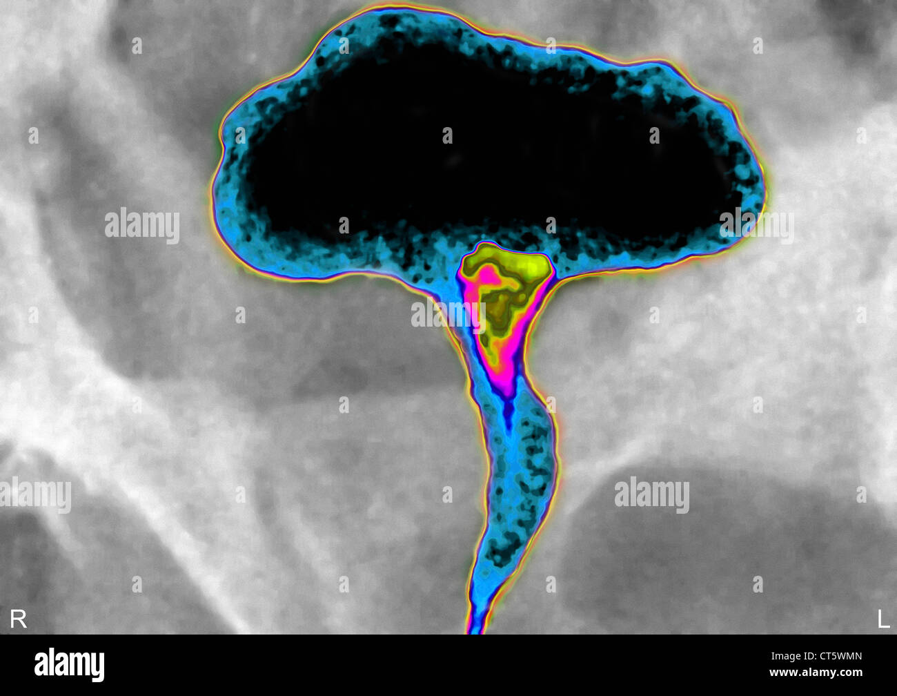 Uro genital tract hi-res stock photography and images - Alamy