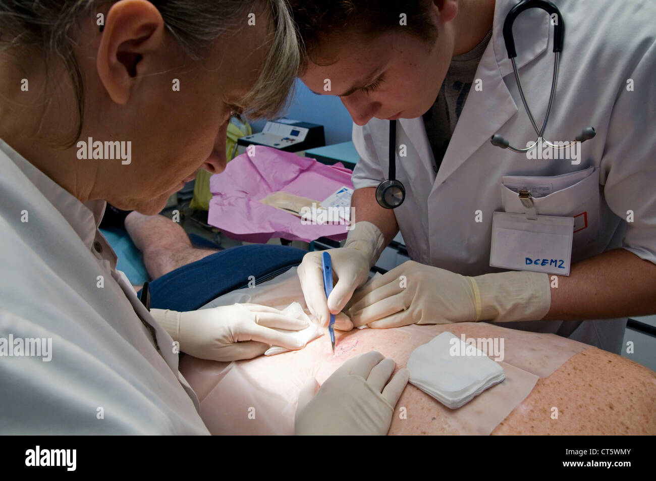 SKIN TUMOR ABLATION Stock Photo - Alamy