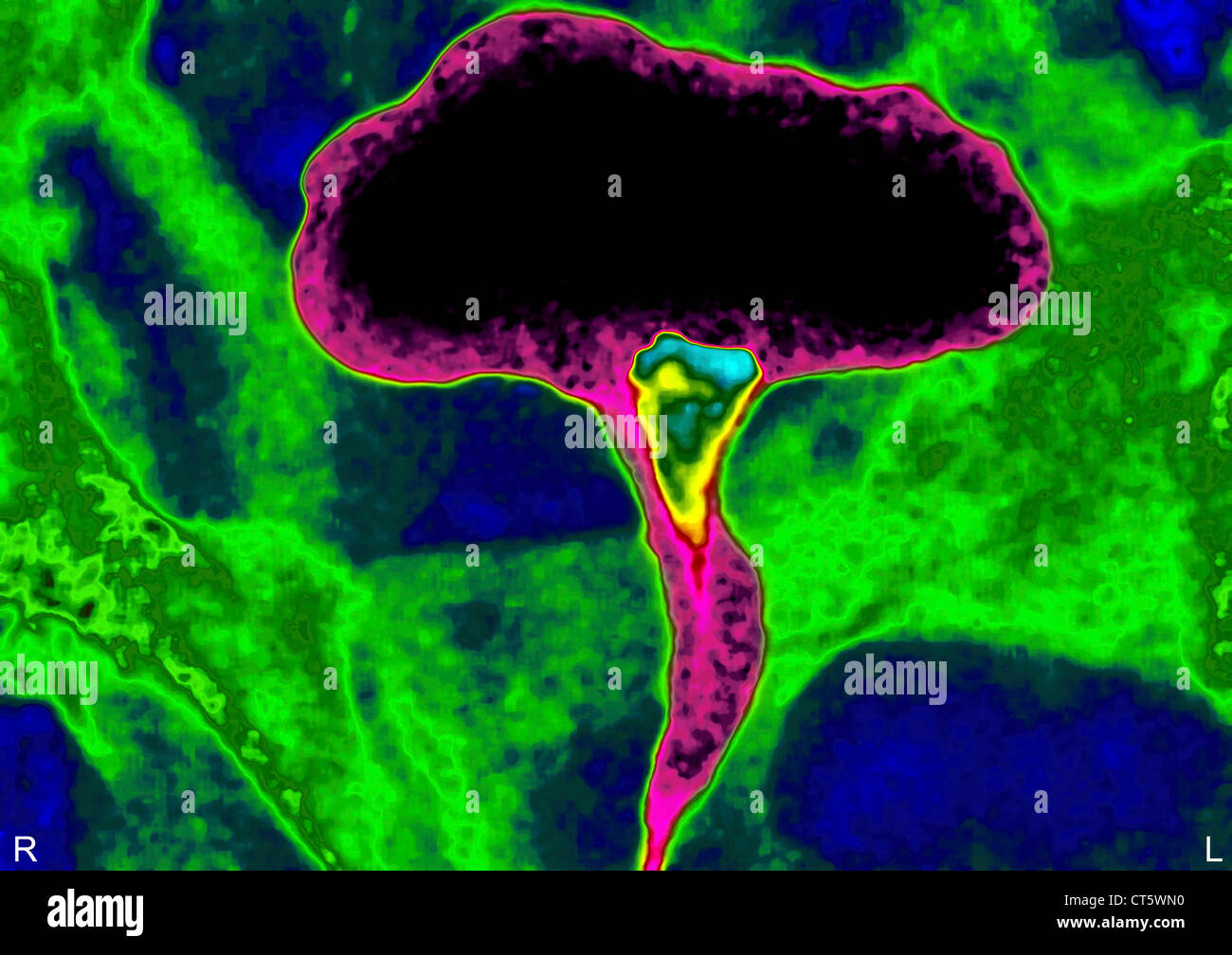 Calculus hi-res stock photography and images - Alamy