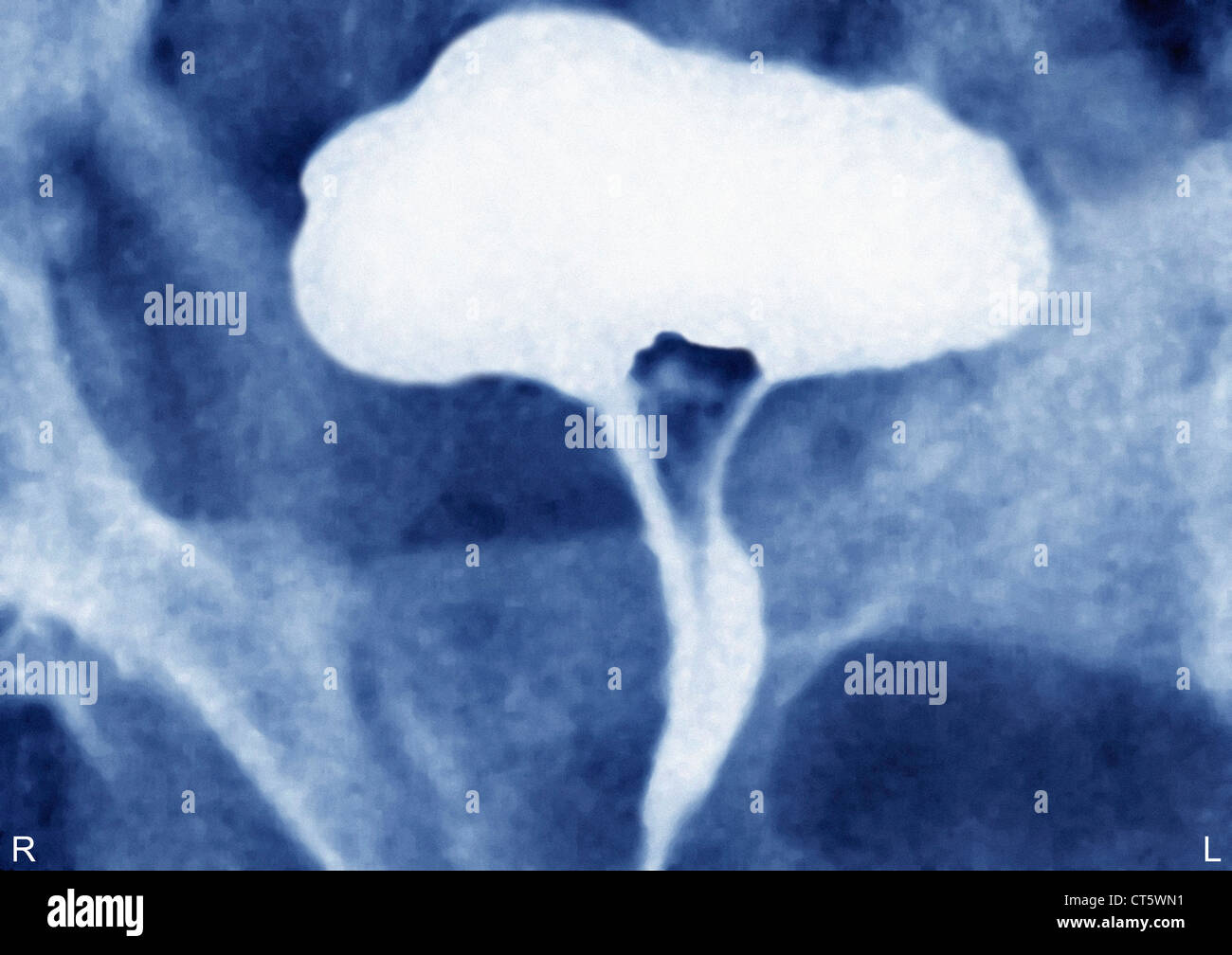 Prostate Examination Stock Photos & Prostate Examination Stock Images ...