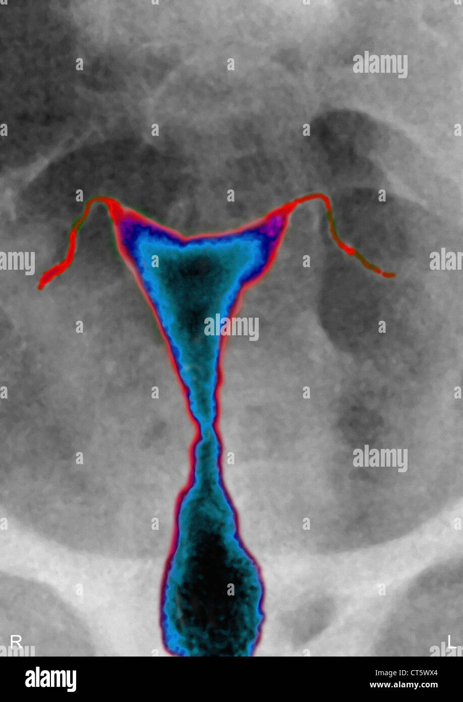 Obstruction hi-res stock photography and images - Alamy