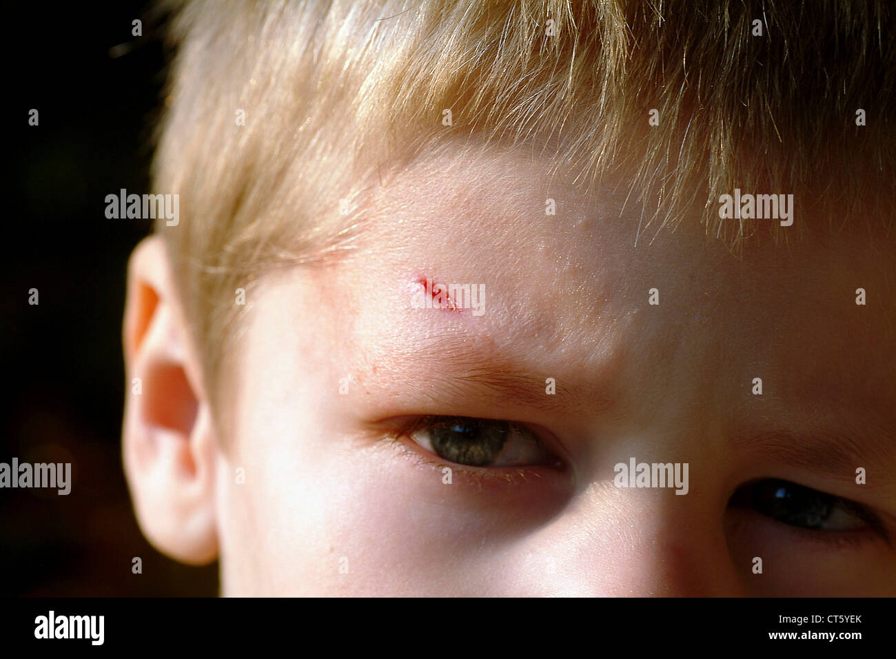 Facial wound hi-res stock photography and images - Alamy