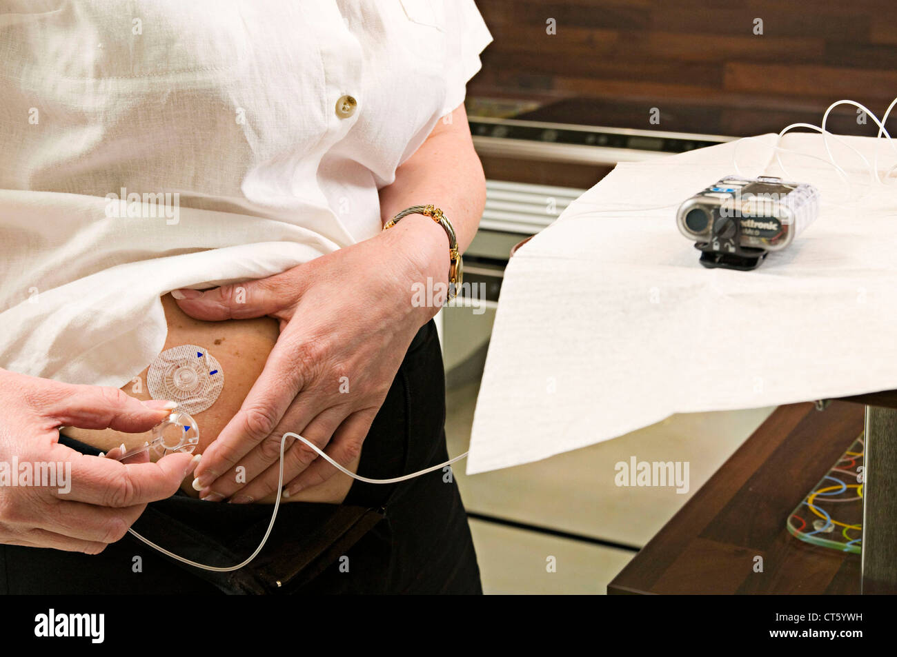 EXTERNAL INSULIN PUMP Stock Photo - Alamy