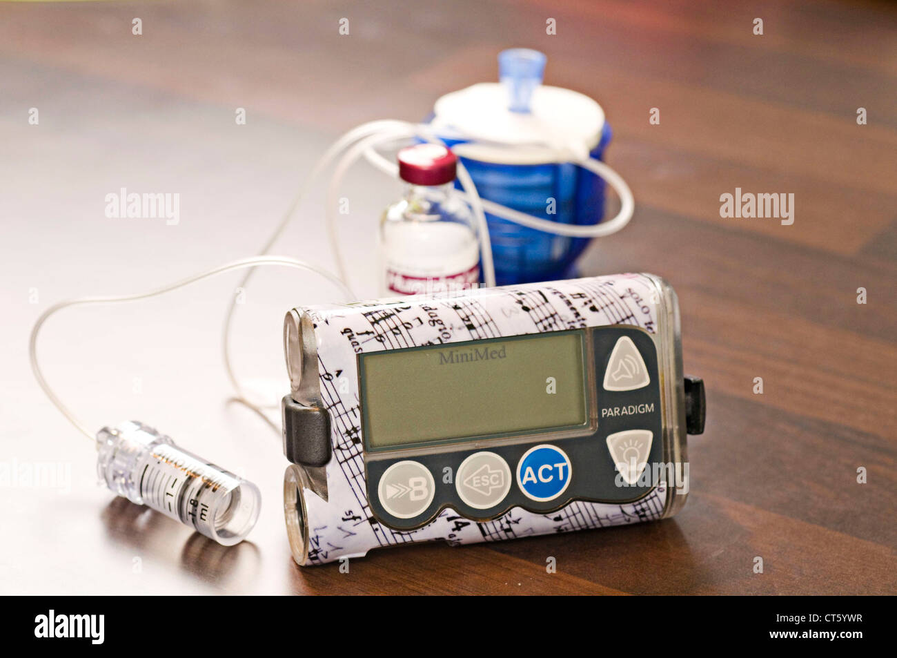 EXTERNAL INSULIN PUMP Stock Photo - Alamy