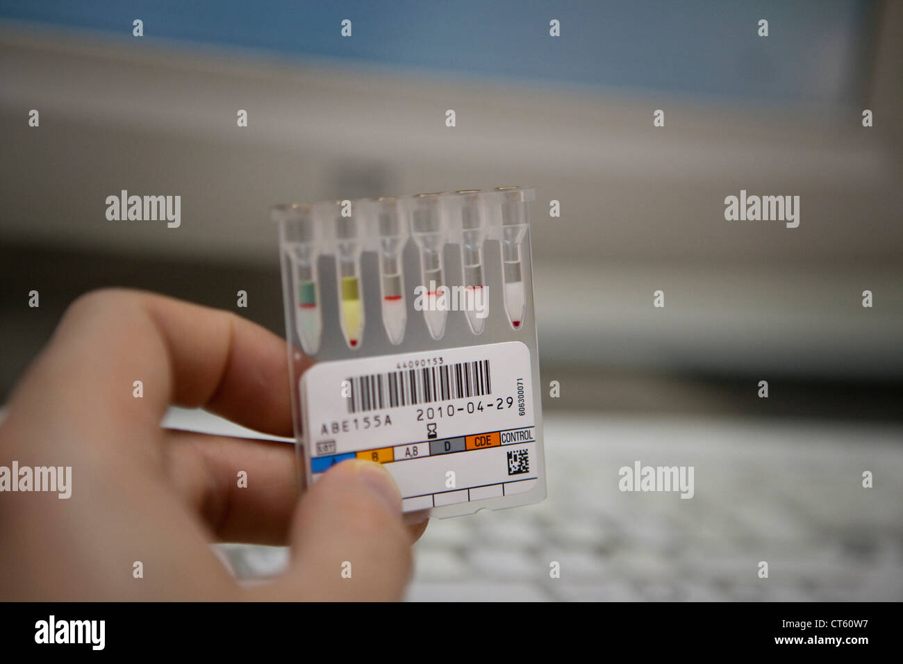 Abo blood type testing hi-res stock photography and images - Alamy