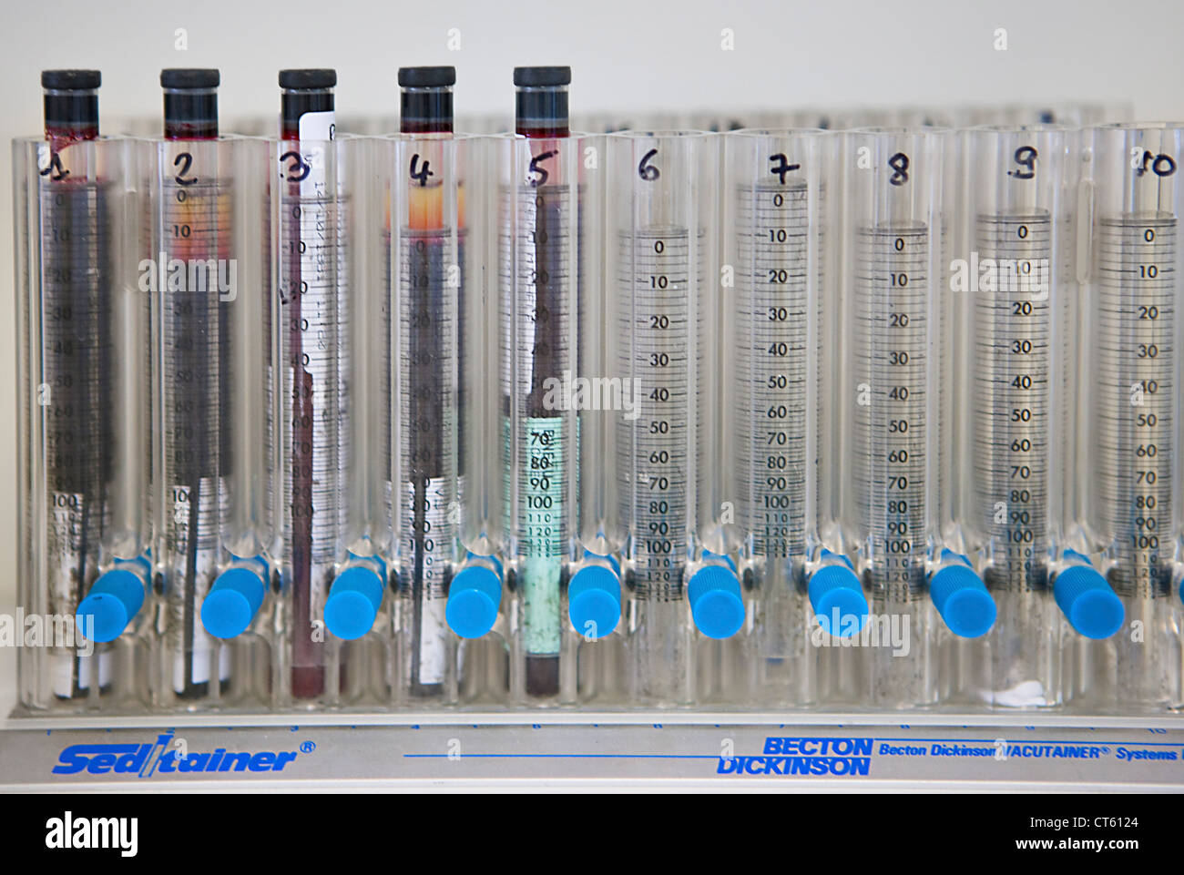 Sedimentation Rate High Resolution Stock Photography and Images - Alamy