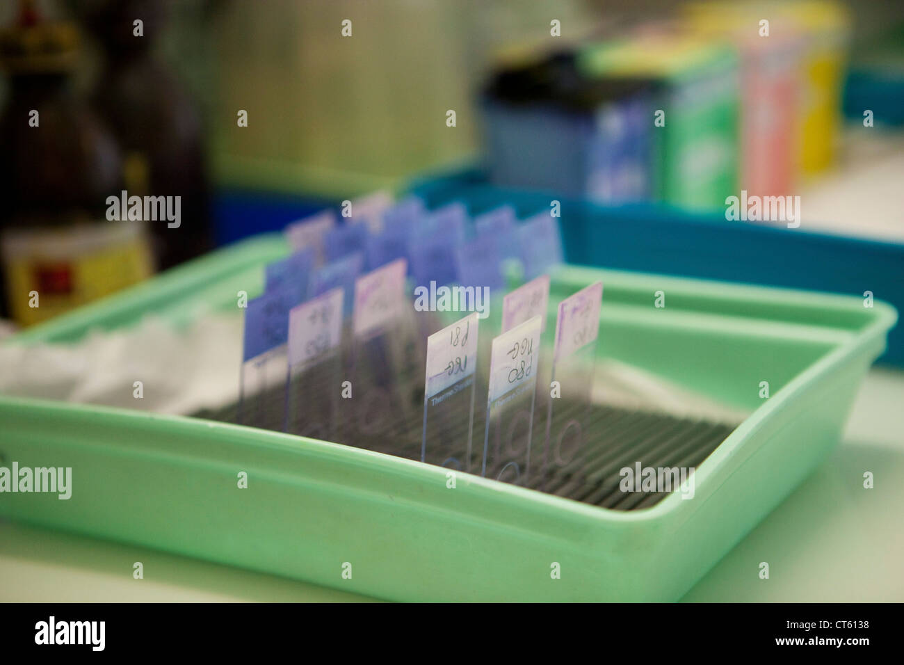 Imaging analysis hi-res stock photography and images - Alamy