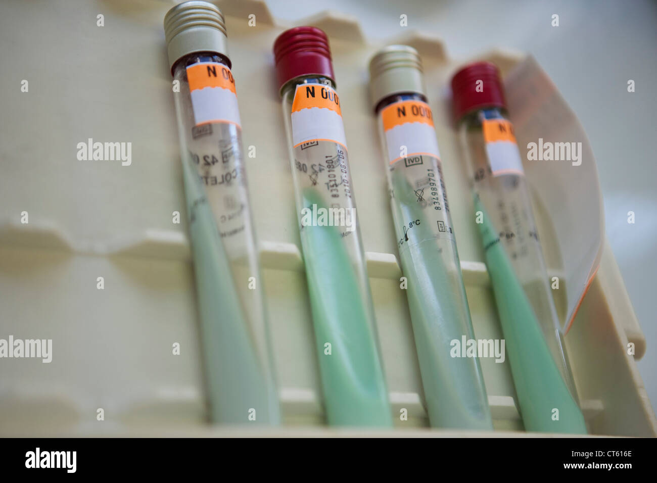 Bacillus tuberculosis culture hi-res stock photography and images - Alamy