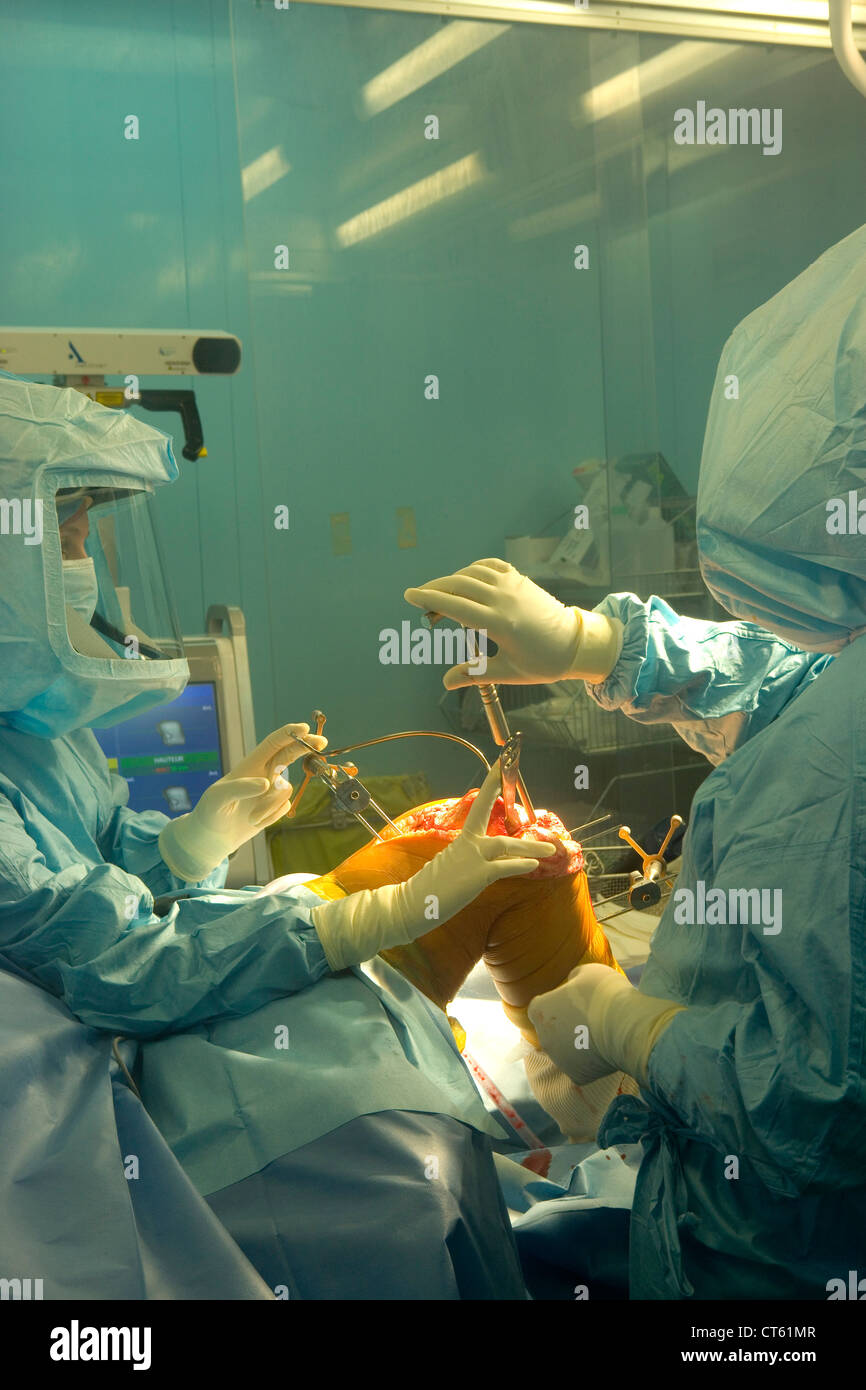 KNEE PROSTHESIS, SURGERY Stock Photo - Alamy