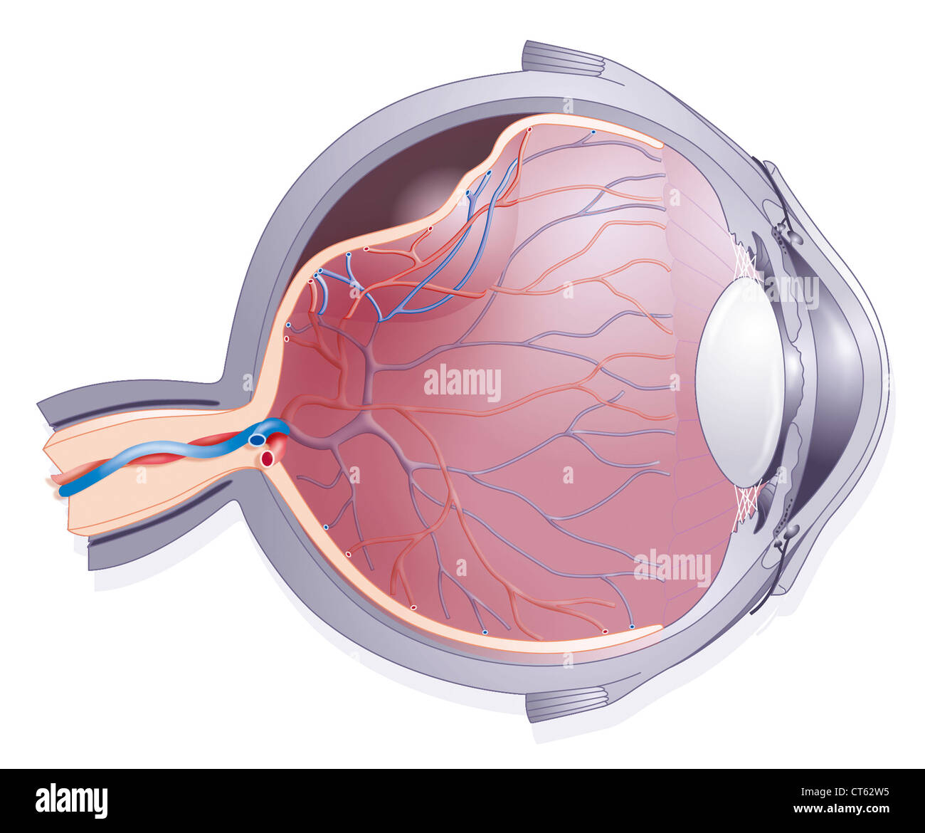 Retinal detachment hi-res stock photography and images - Alamy