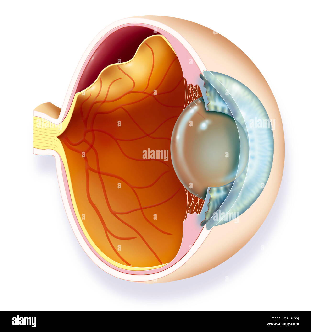 Retinal detachment hi-res stock photography and images - Alamy
