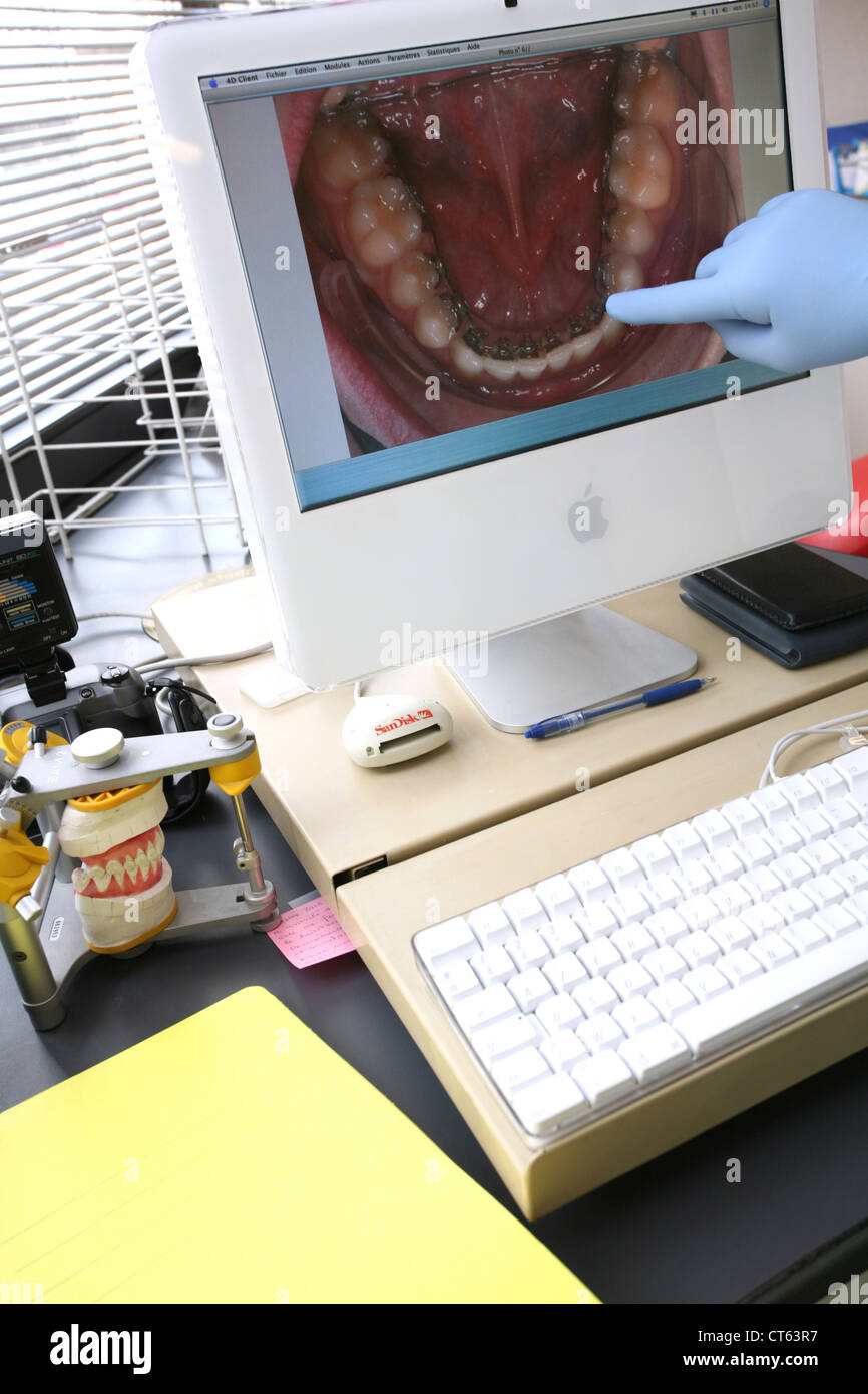 Brackets people human human hi-res stock photography and images - Alamy