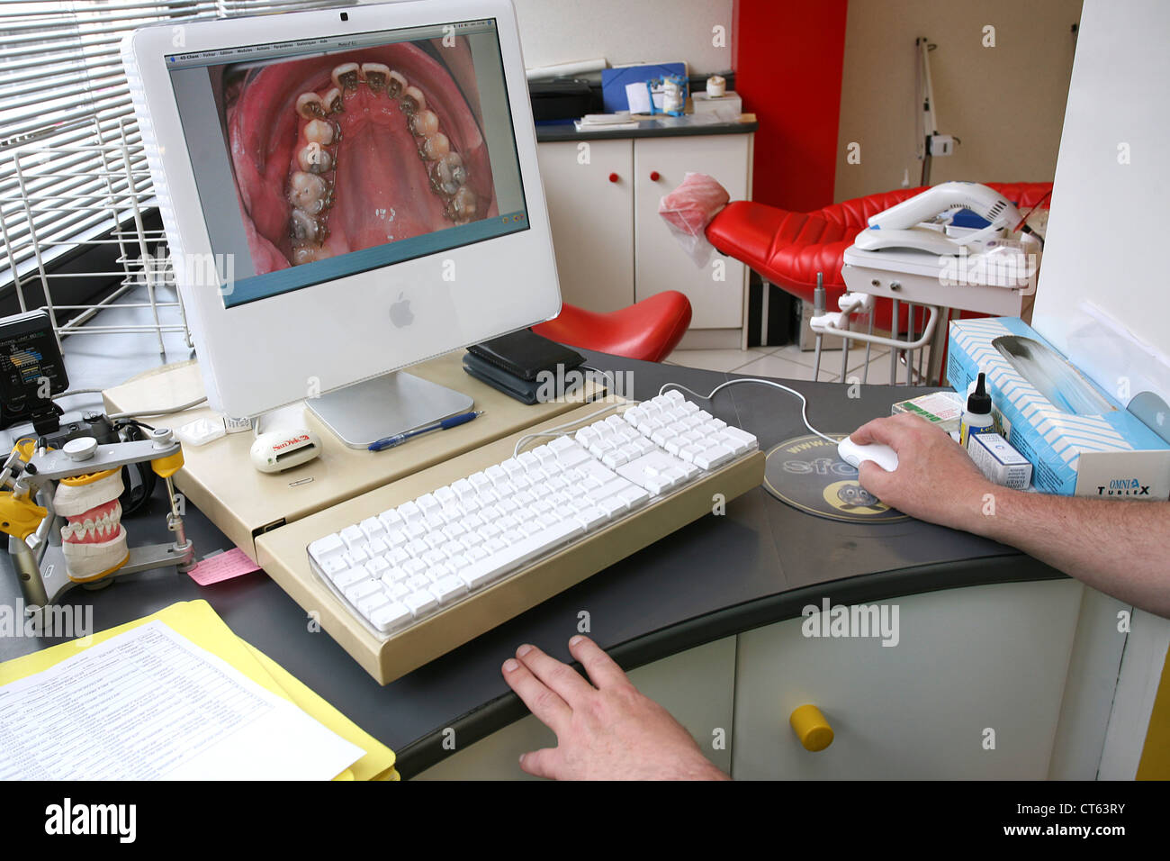 Tooth malposition hi-res stock photography and images - Alamy