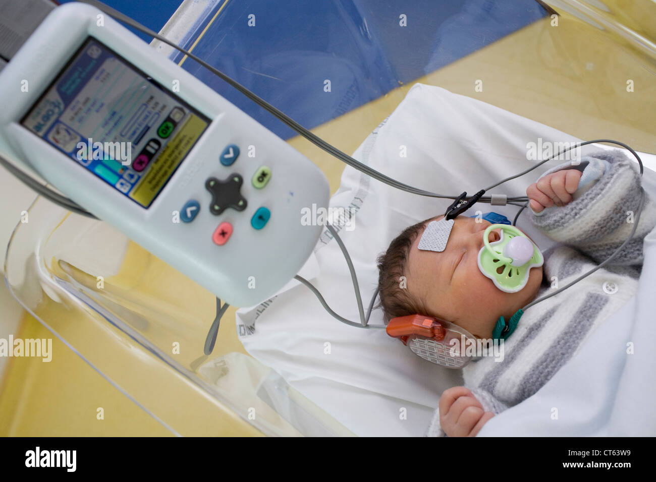AUDIOMETRY, NEWBORN BABY Stock Photo - Alamy
