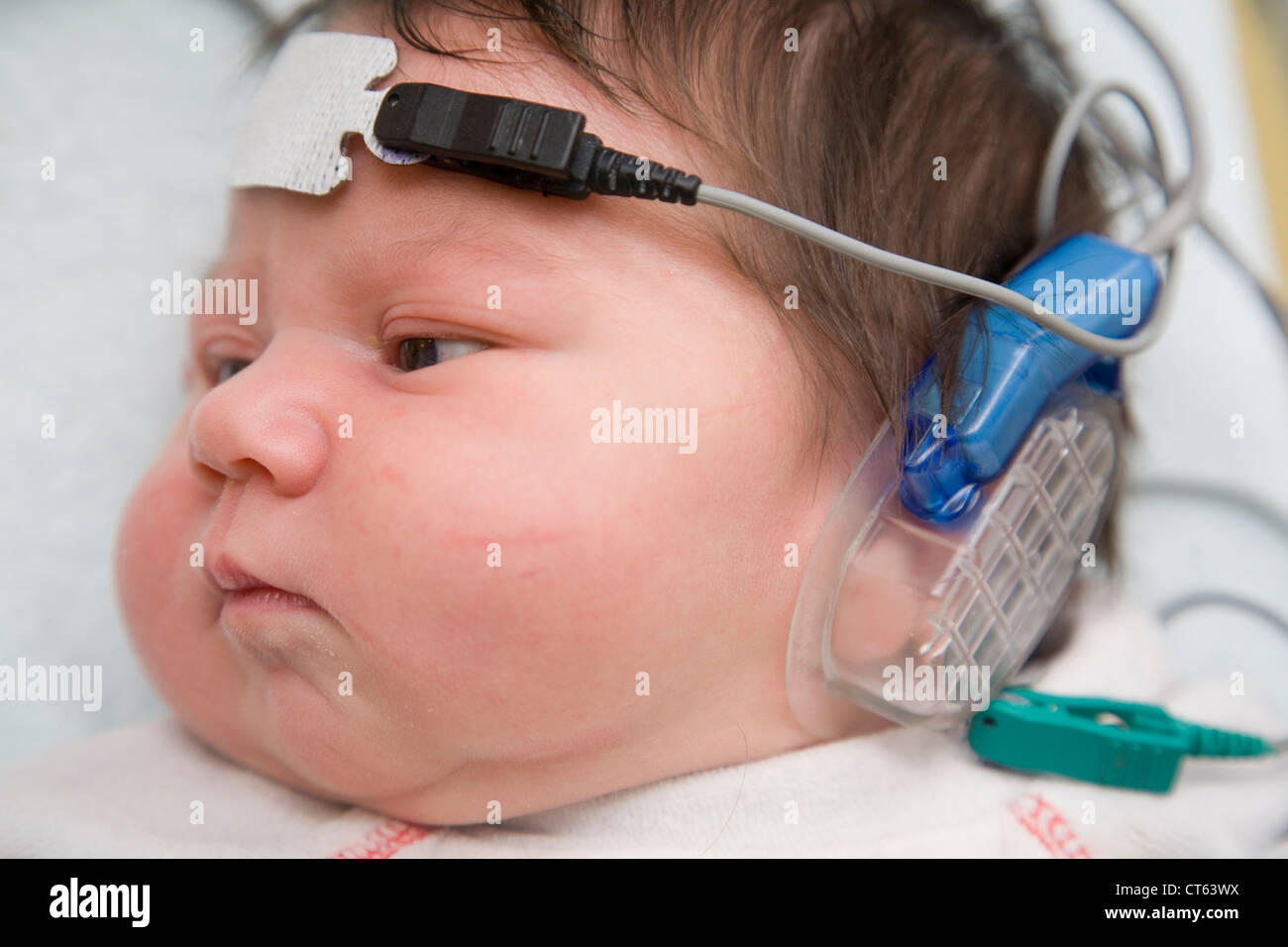 AUDIOMETRY, NEWBORN BABY Stock Photo - Alamy