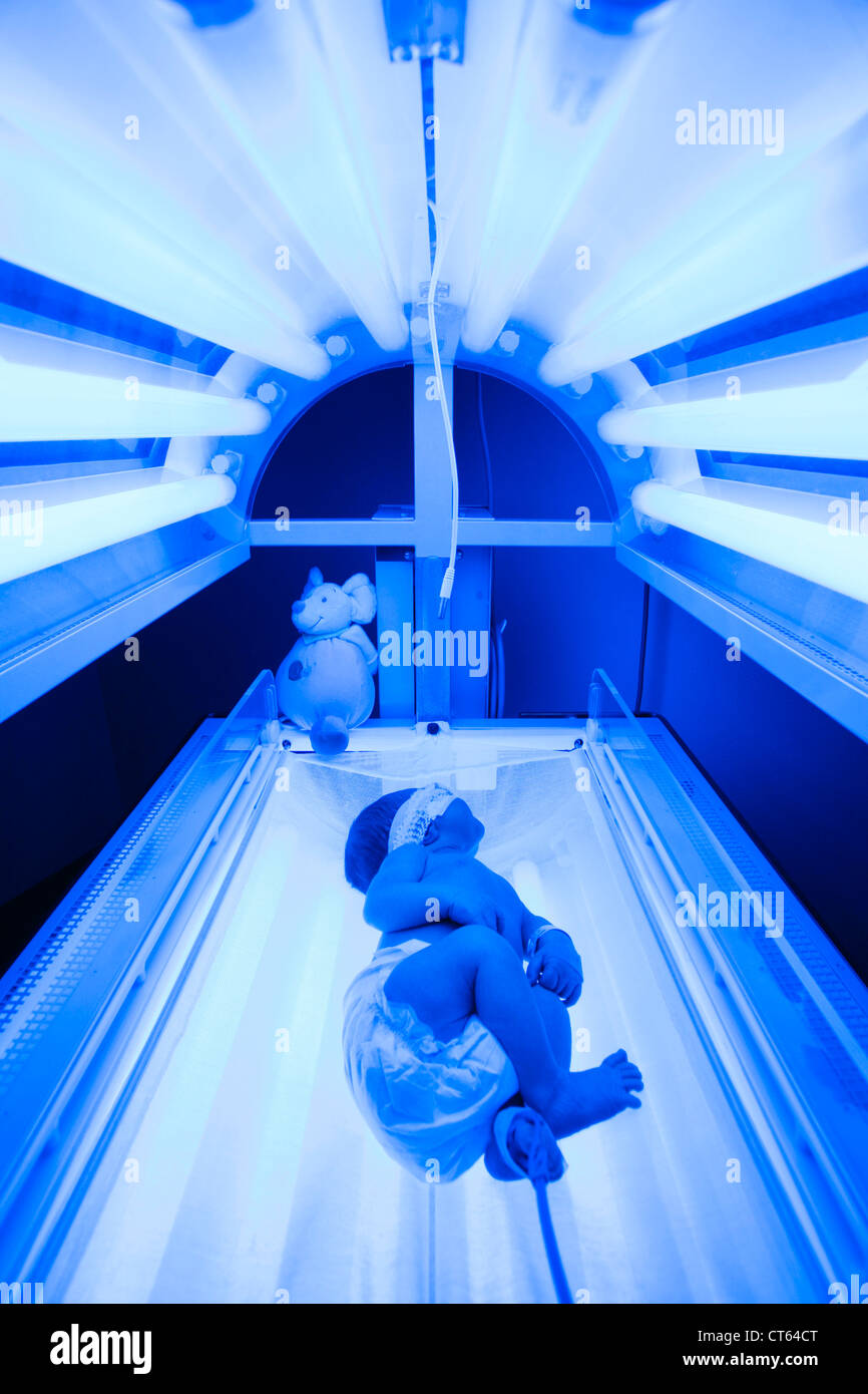 NEONATAL JAUNDICE, PHOTOTHERAPY Stock Photo - Alamy