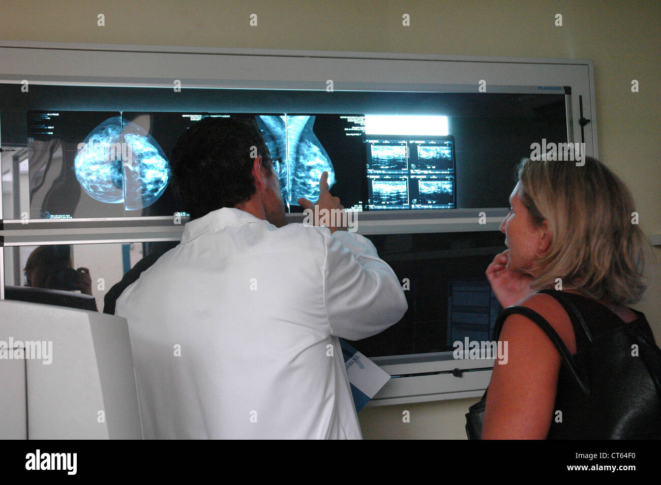 Mammography hi-res stock photography and images - Alamy