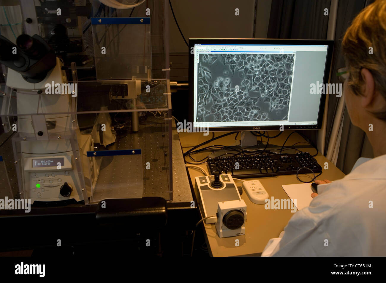 Videomicroscopy hi-res stock photography and images - Alamy